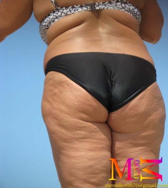 This Woman Has Cellulite All Over Her Butt & Thighs | Scrolller