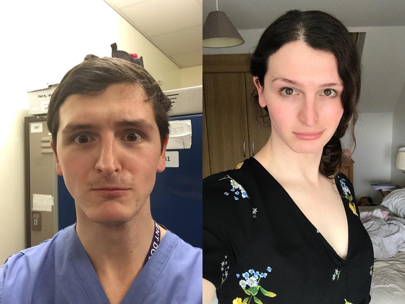 Transition has essentially made me pale! | Scrolller