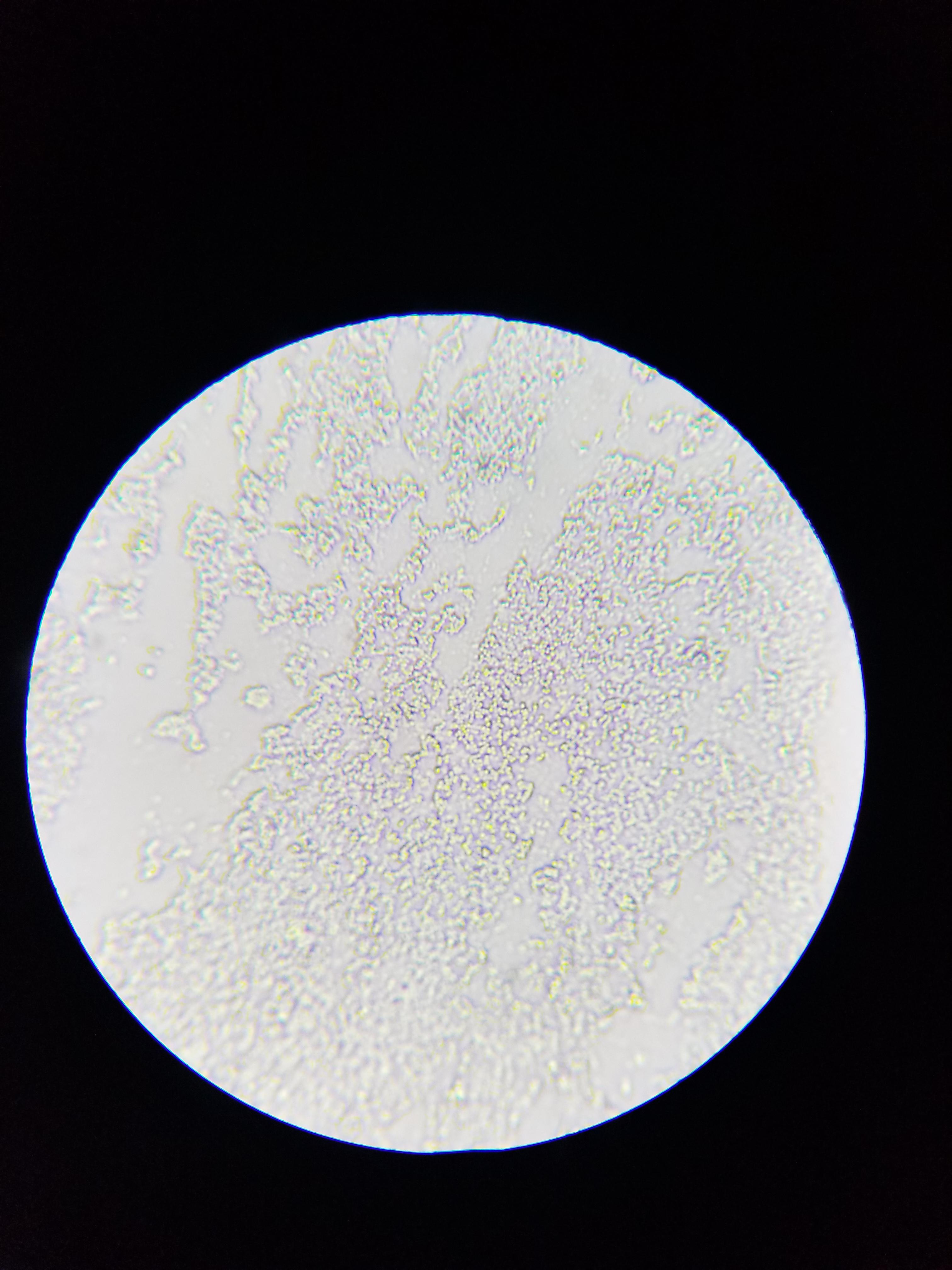 Veillonella? Identification Part 2 (800x) | Scrolller
