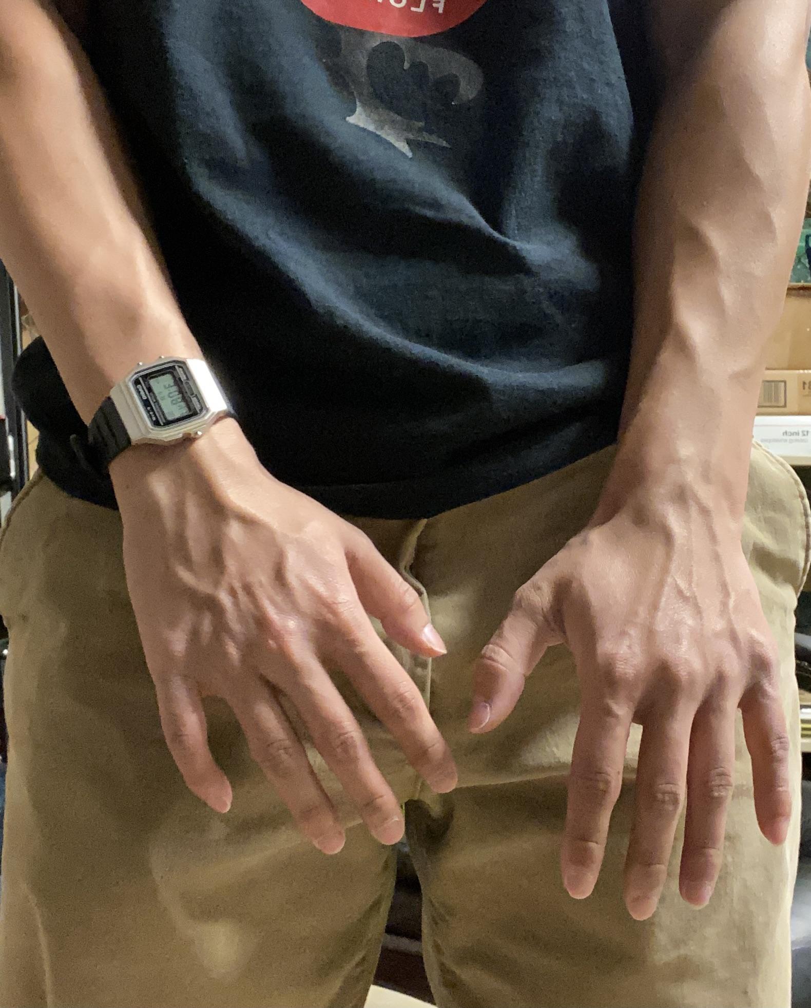 Veins for days | Scrolller