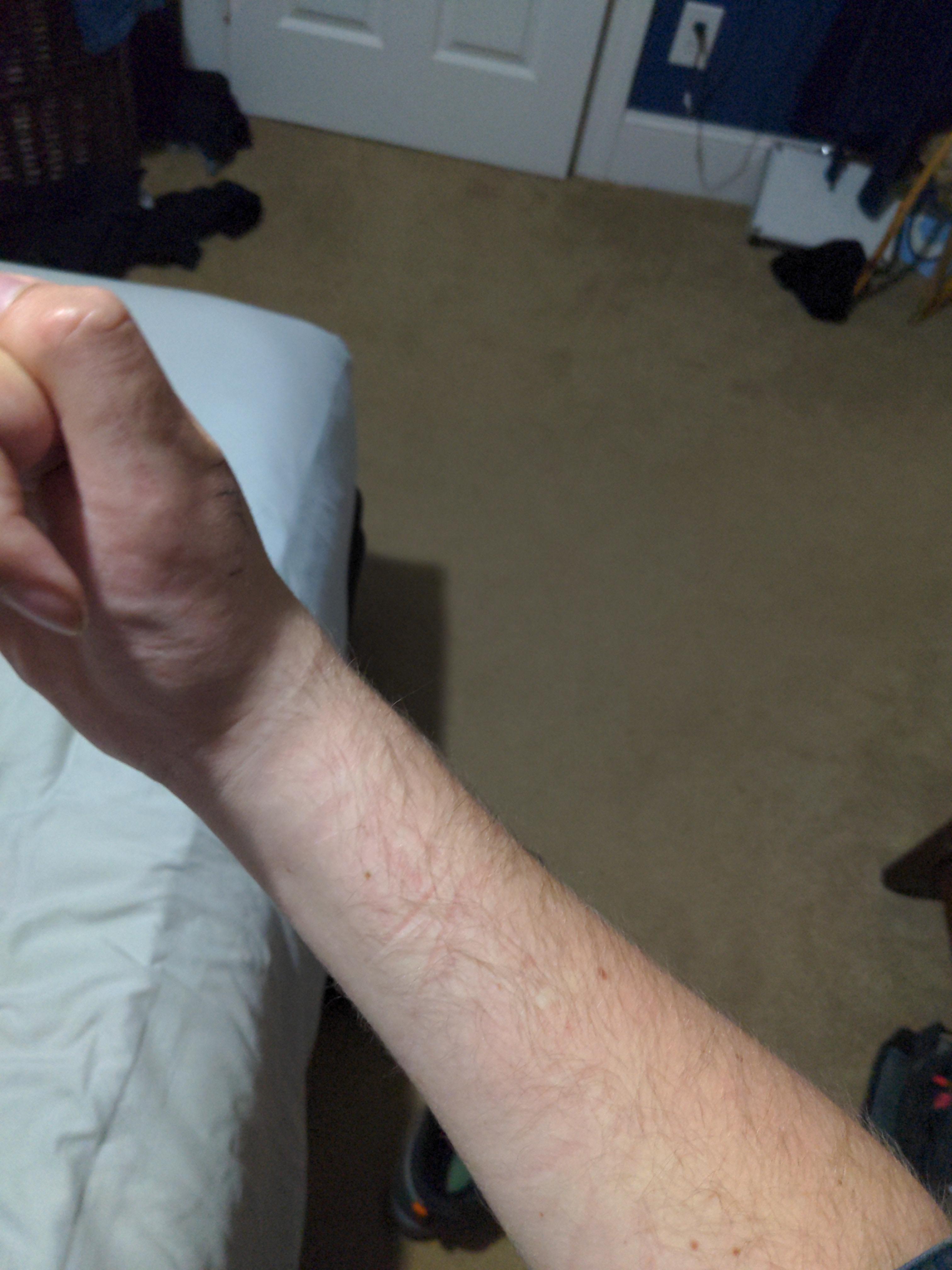 Weak scars | Scrolller