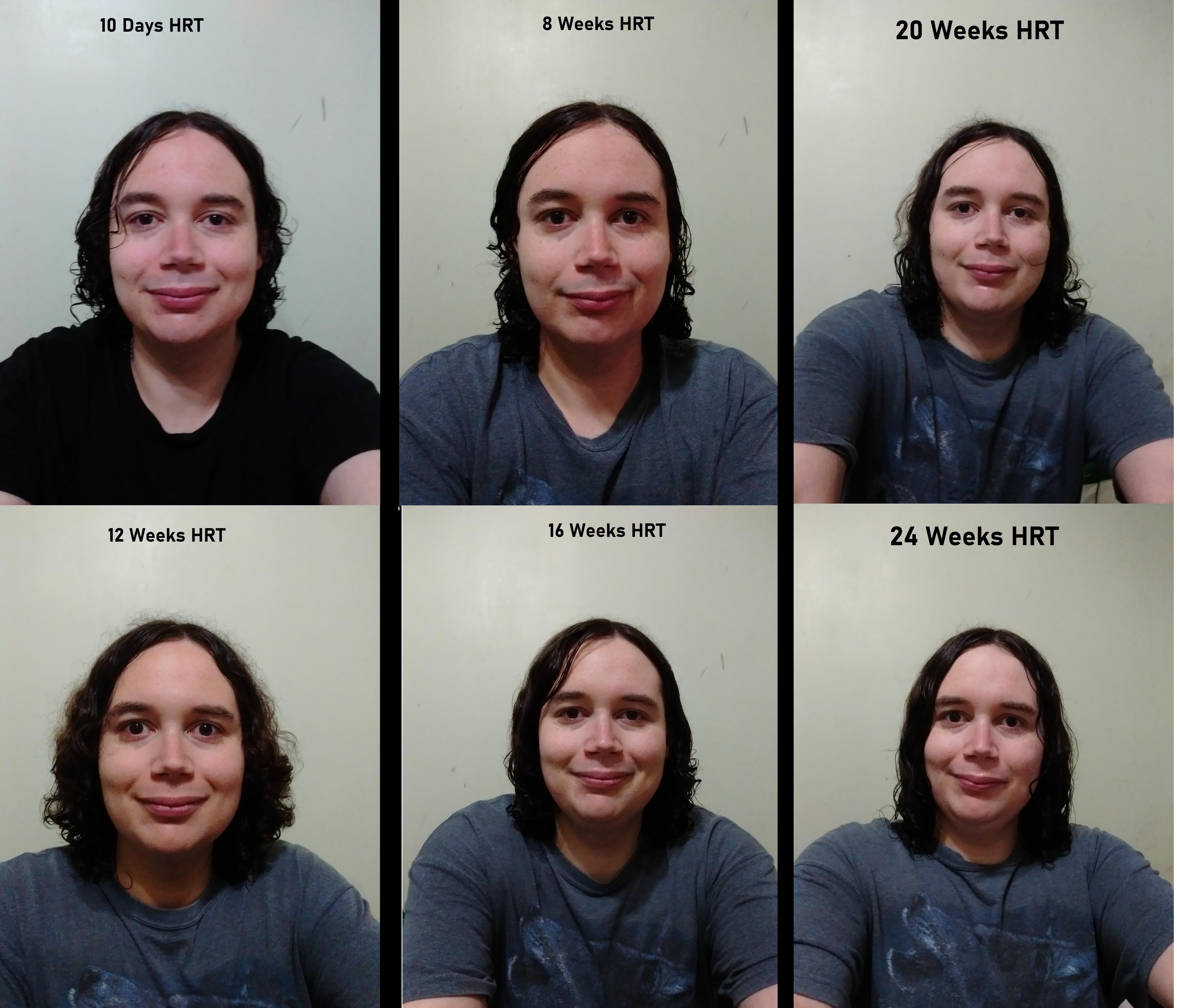 Wednesday was my 24 week mark, so here's an updated timeline! | Scrolller