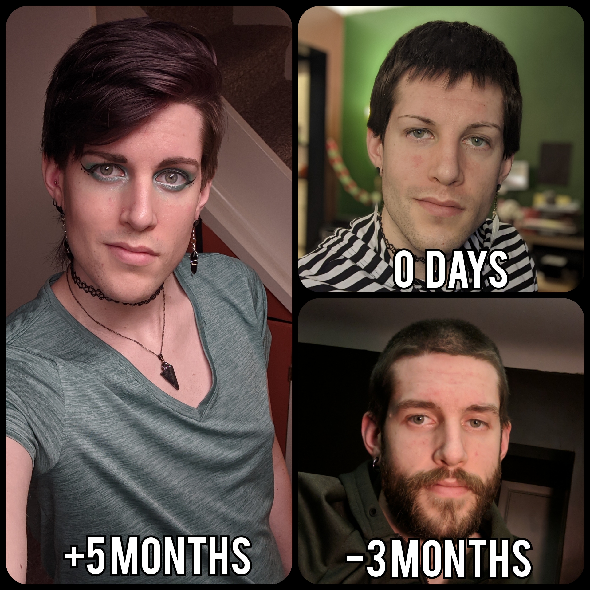 What even makes a person look feminine? I can't tell anymore. 5 months (MtF) | Scrolller