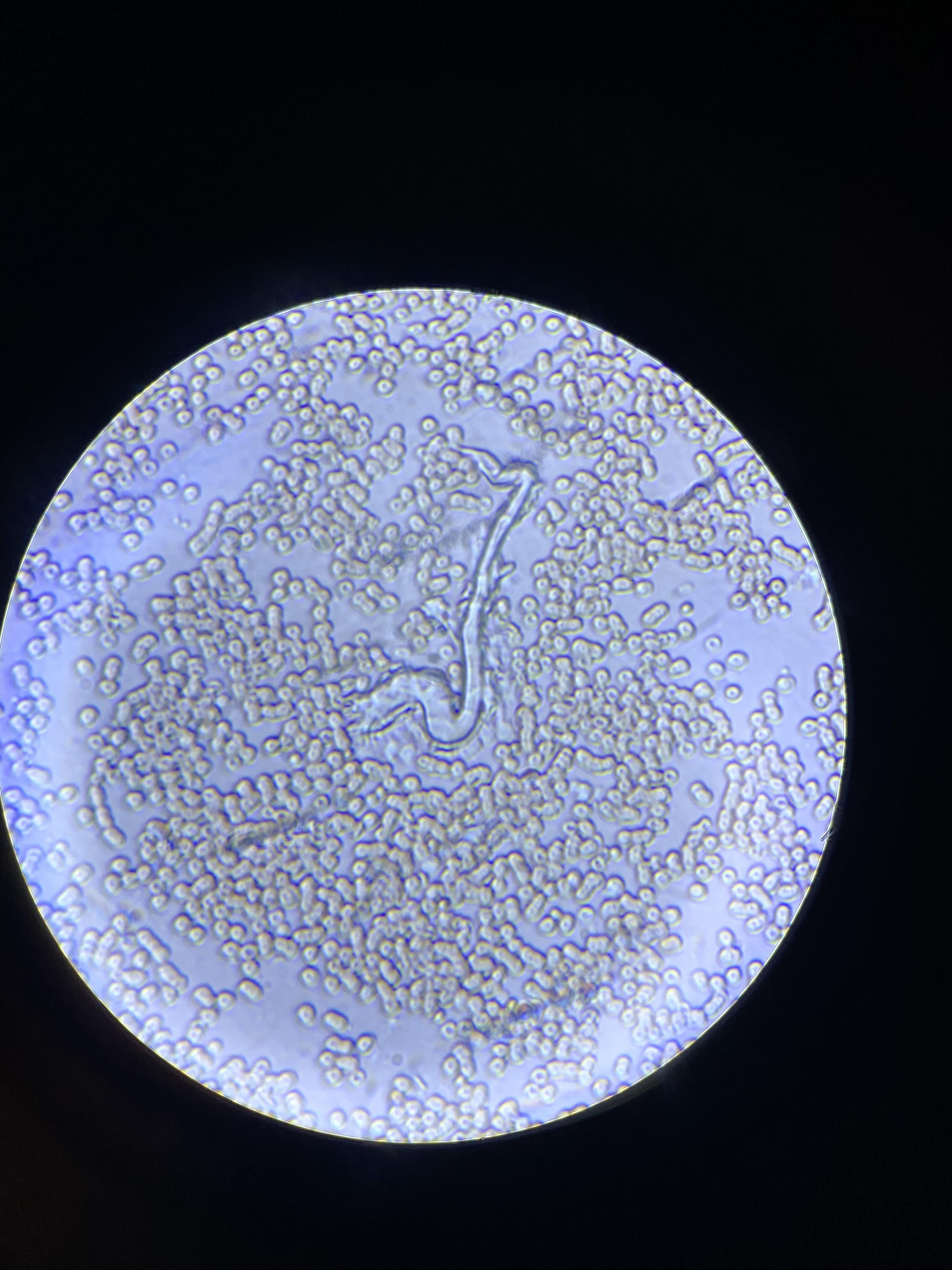 What is this? A defect on my slide? | Scrolller