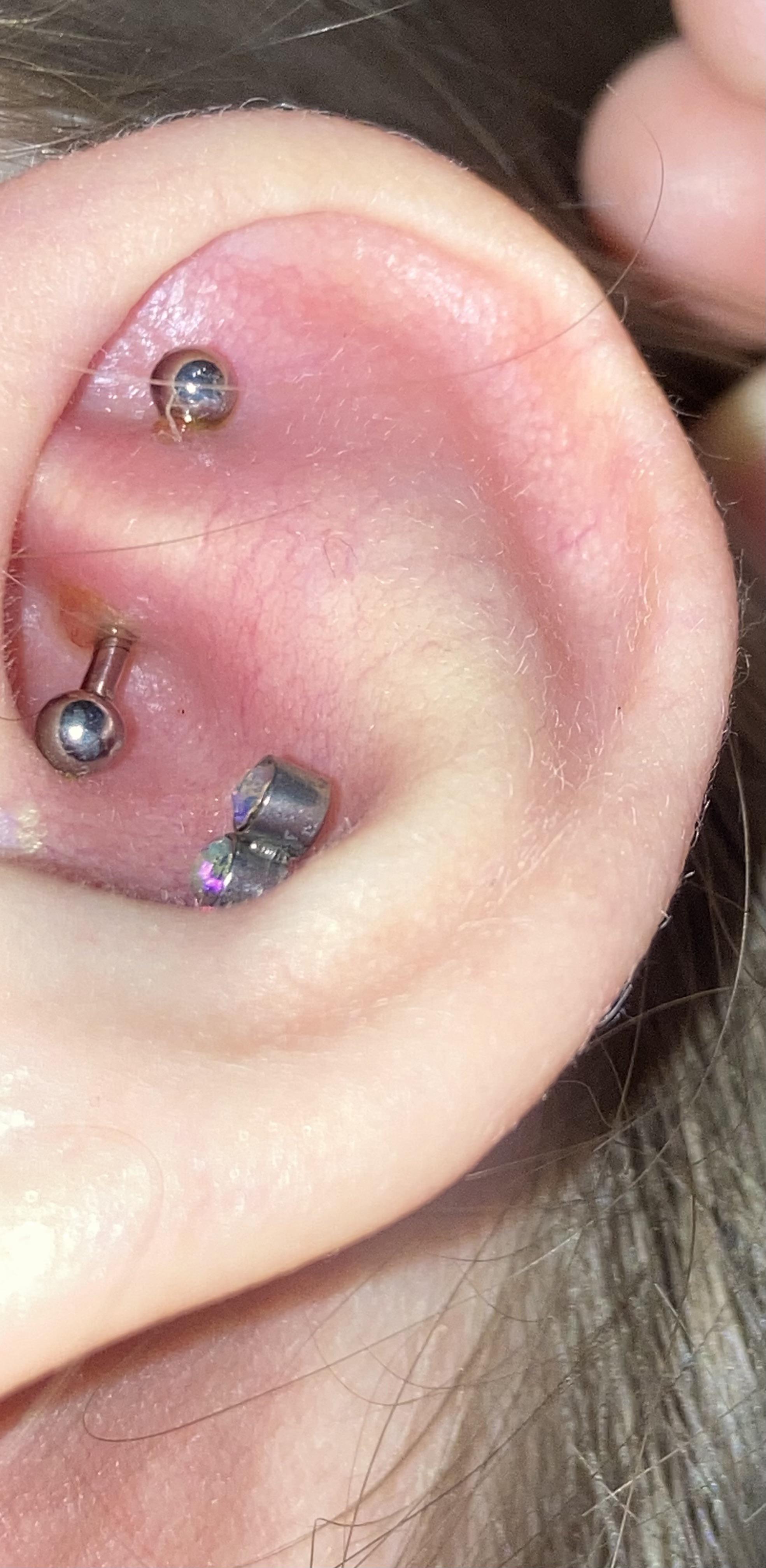 What is this on the bottom of my rook? It doesn’t look like a normal piercing bump | Scrolller