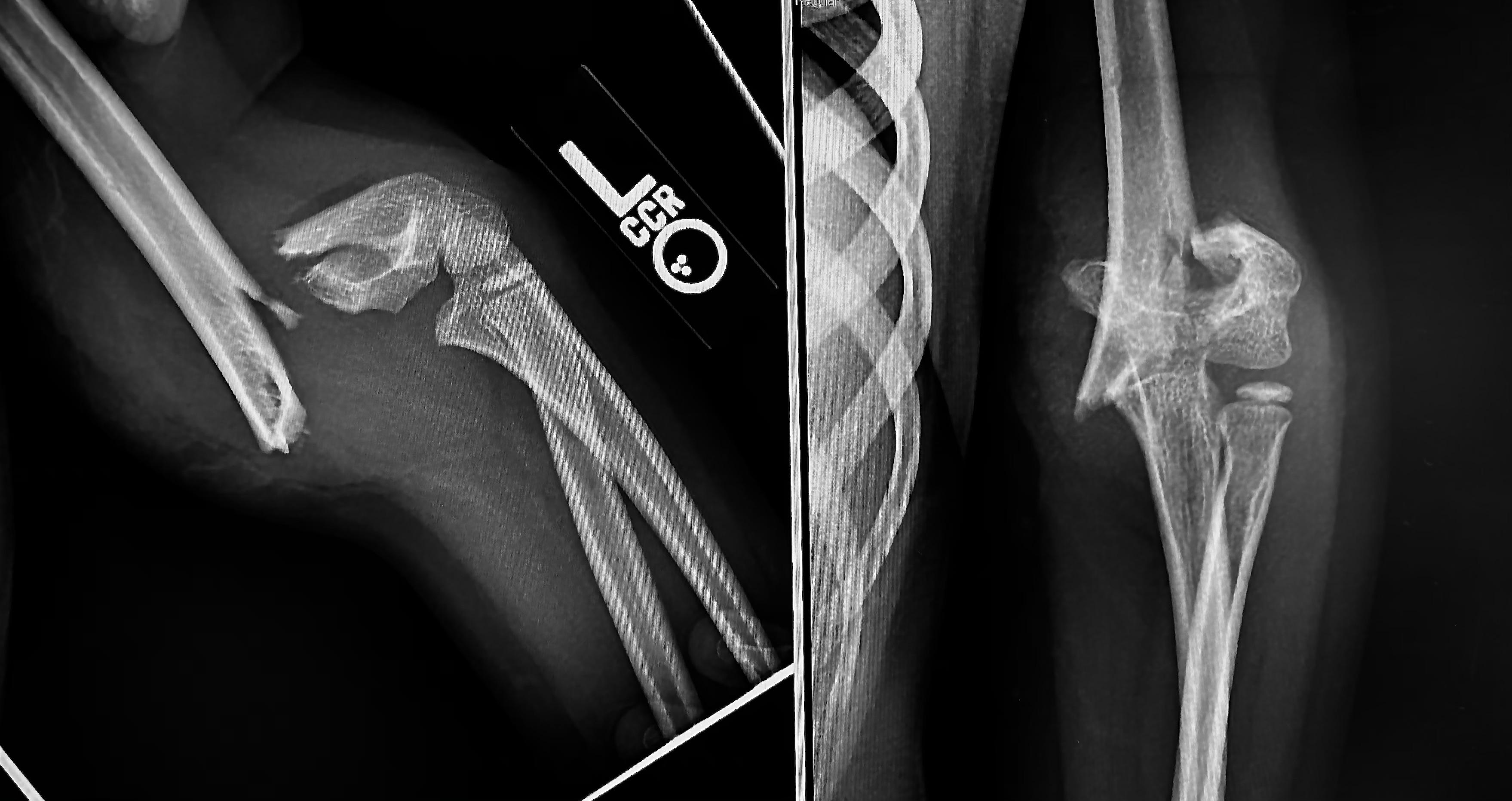When your AP position produces your lateral projection. | Scrolller