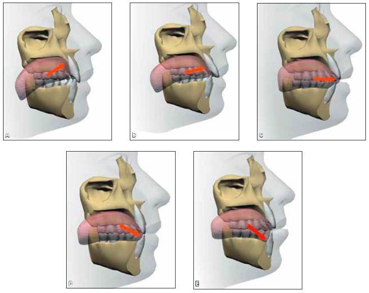 Which direction of mewing guides the maxilla best? | Scrolller
