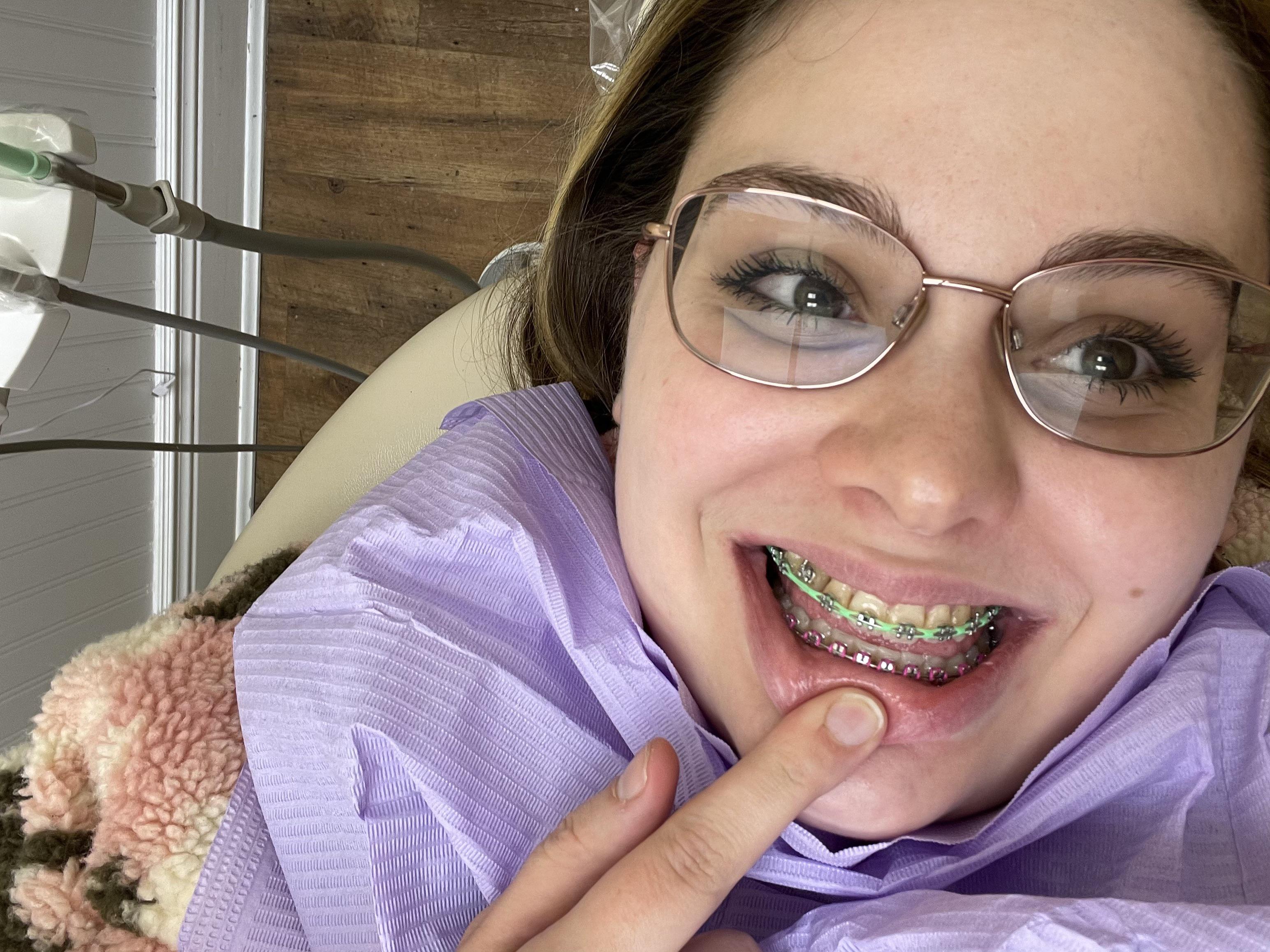 Are my braces cute 🥰🥰 | Scrolller