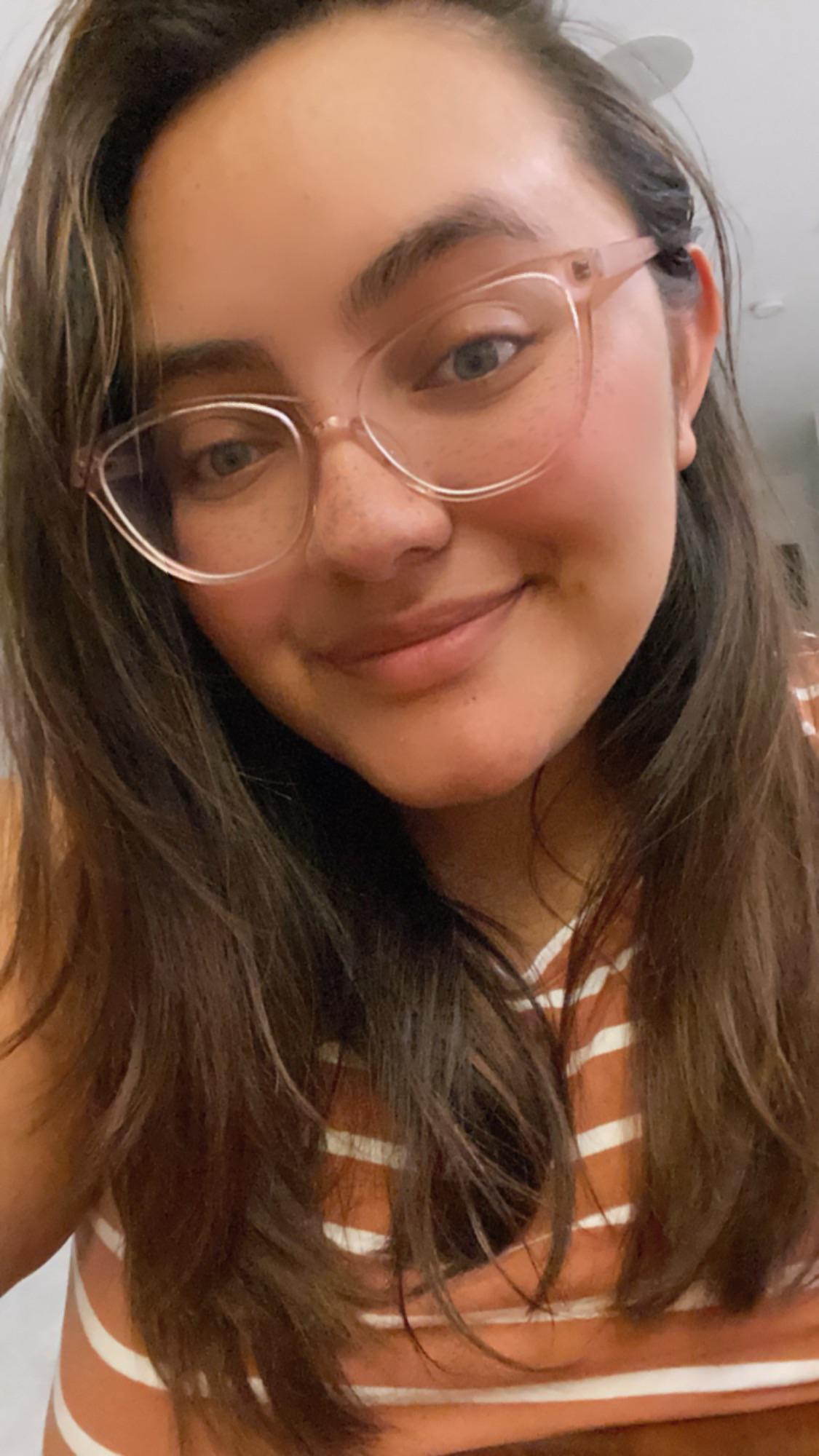 Wish i had more freckles like this (24f) | Scrolller