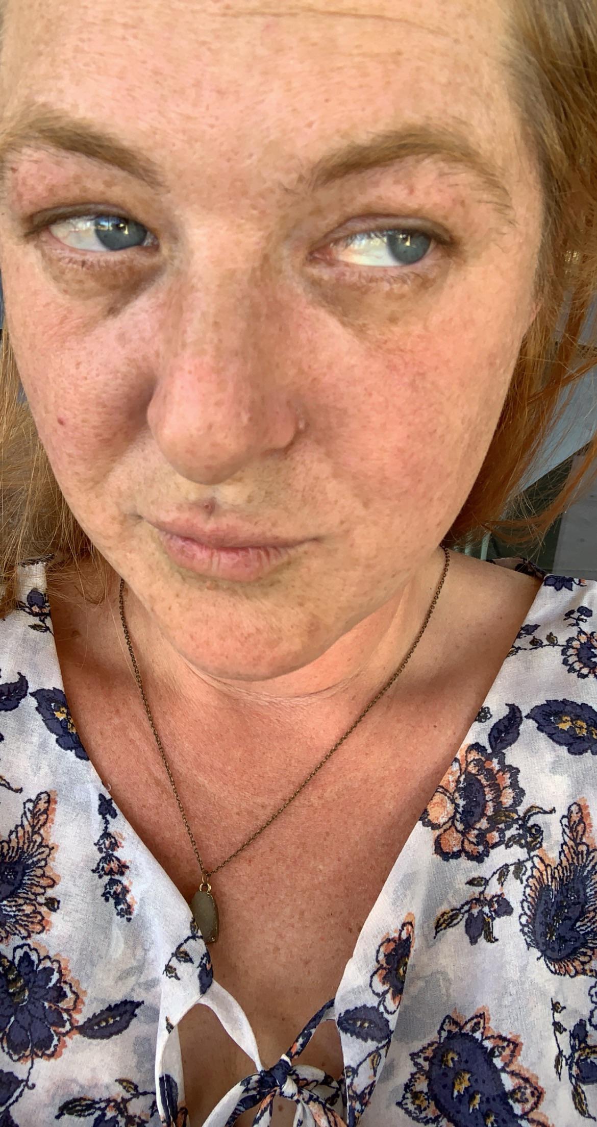 You guys always love to see my freckles so here they are again. ️ | Scrolller