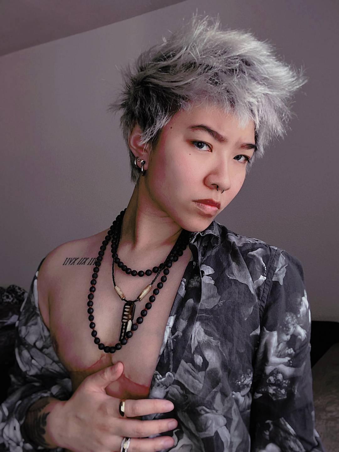 1 Month Post-Op and feeling myself 🥰 | Scrolller