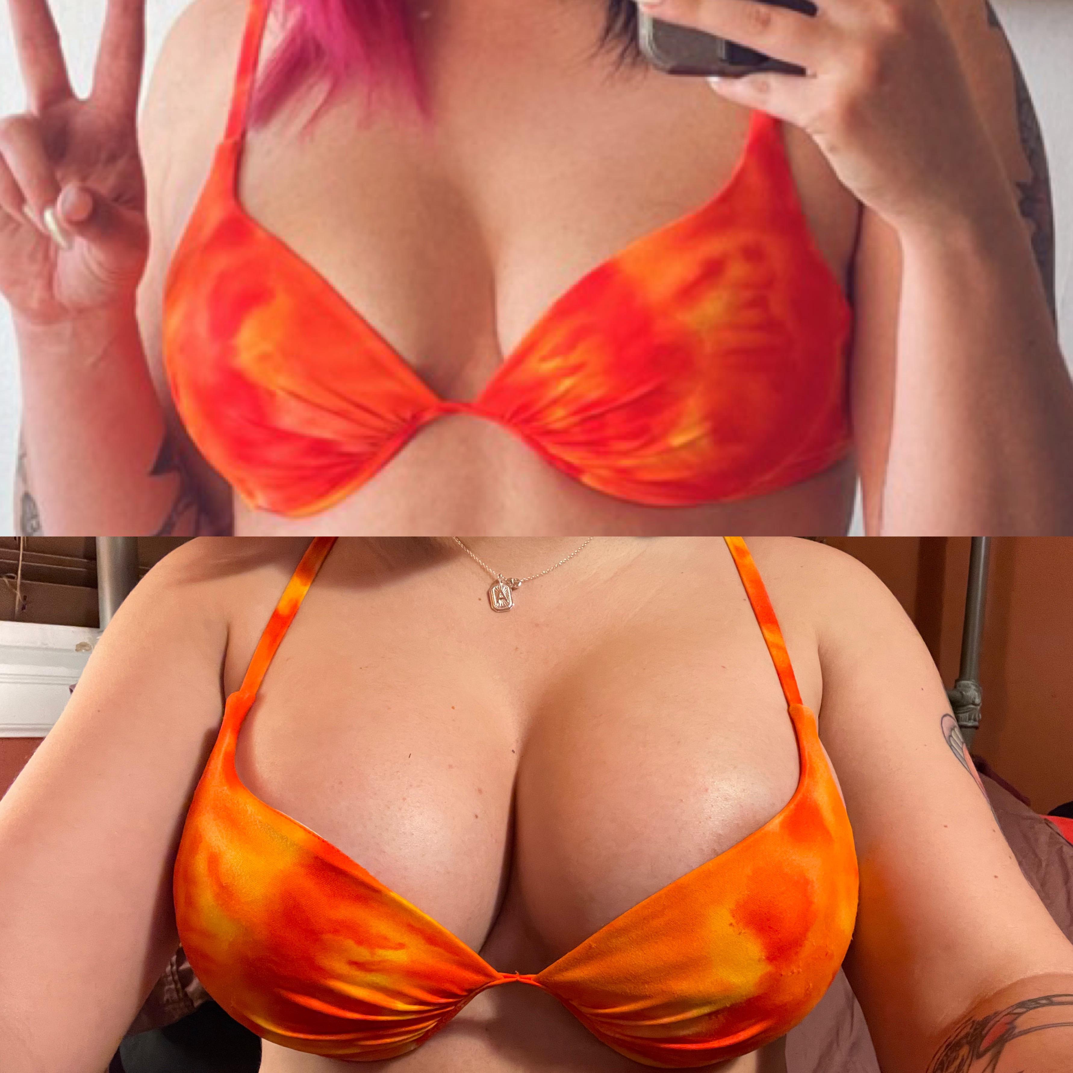 1000ccs later | Scrolller