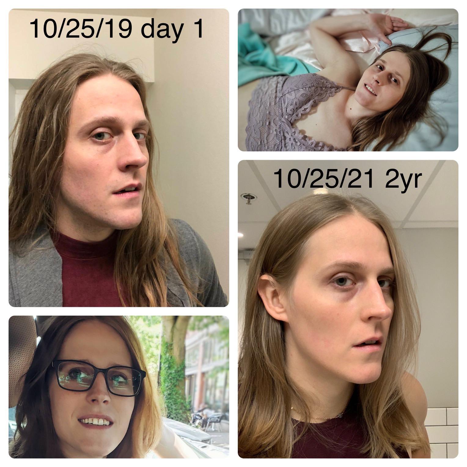 2 year HRT-versary!!! :D | Scrolller