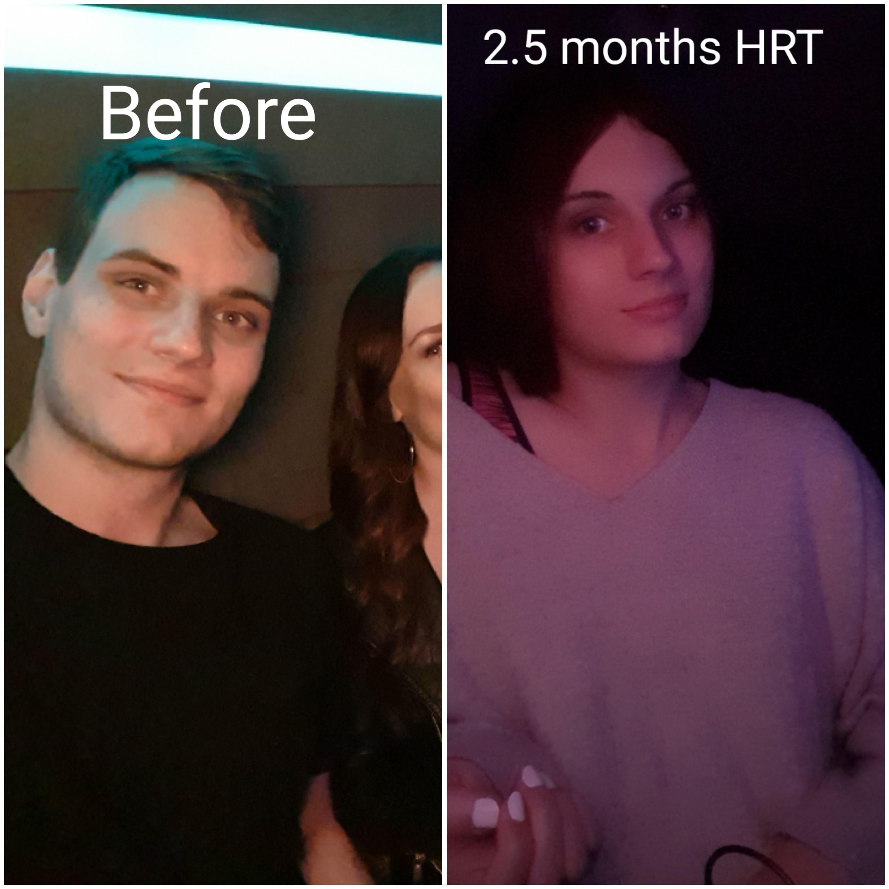 24 MtF 2.5 Months HRT. Still early days but how am I doing so far? | Scrolller