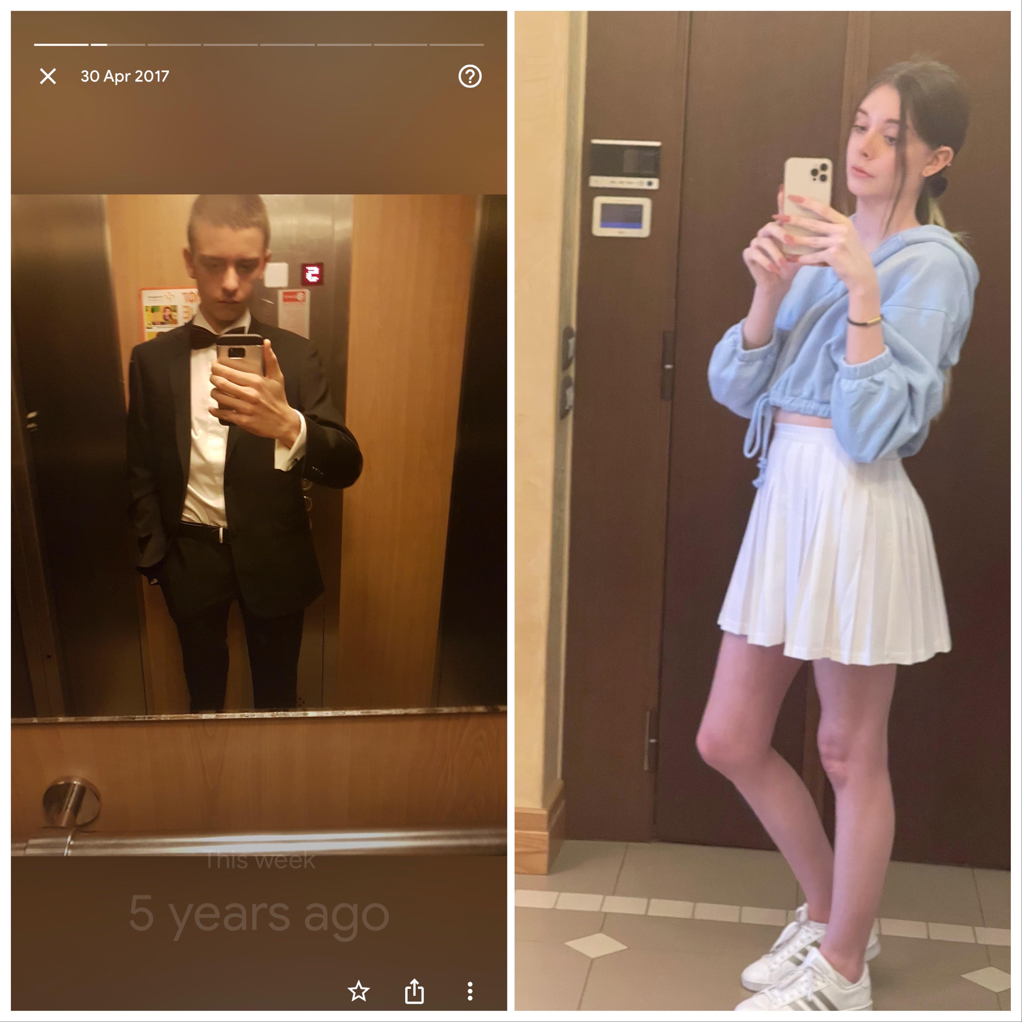 5 years ago-> today 🌸 | Scrolller