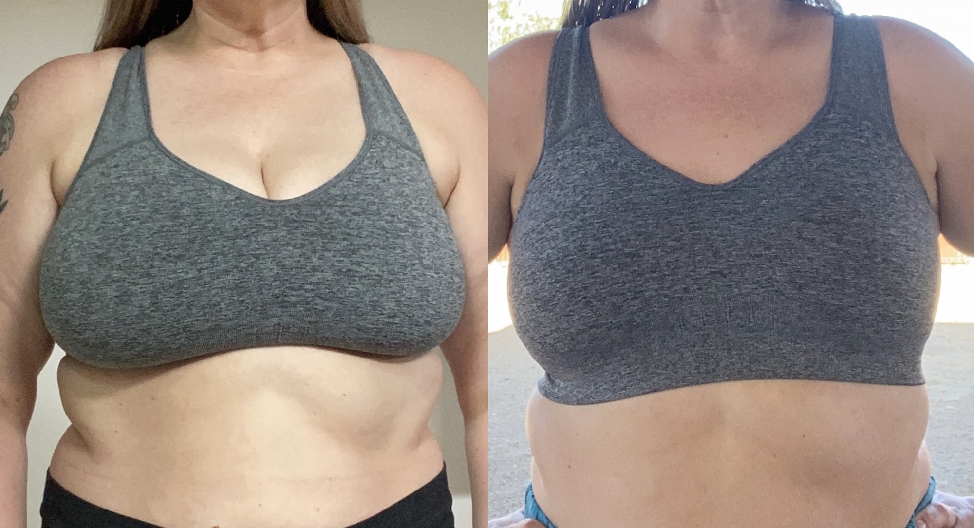 8w post op, same bra different boobs 🎉 | Scrolller