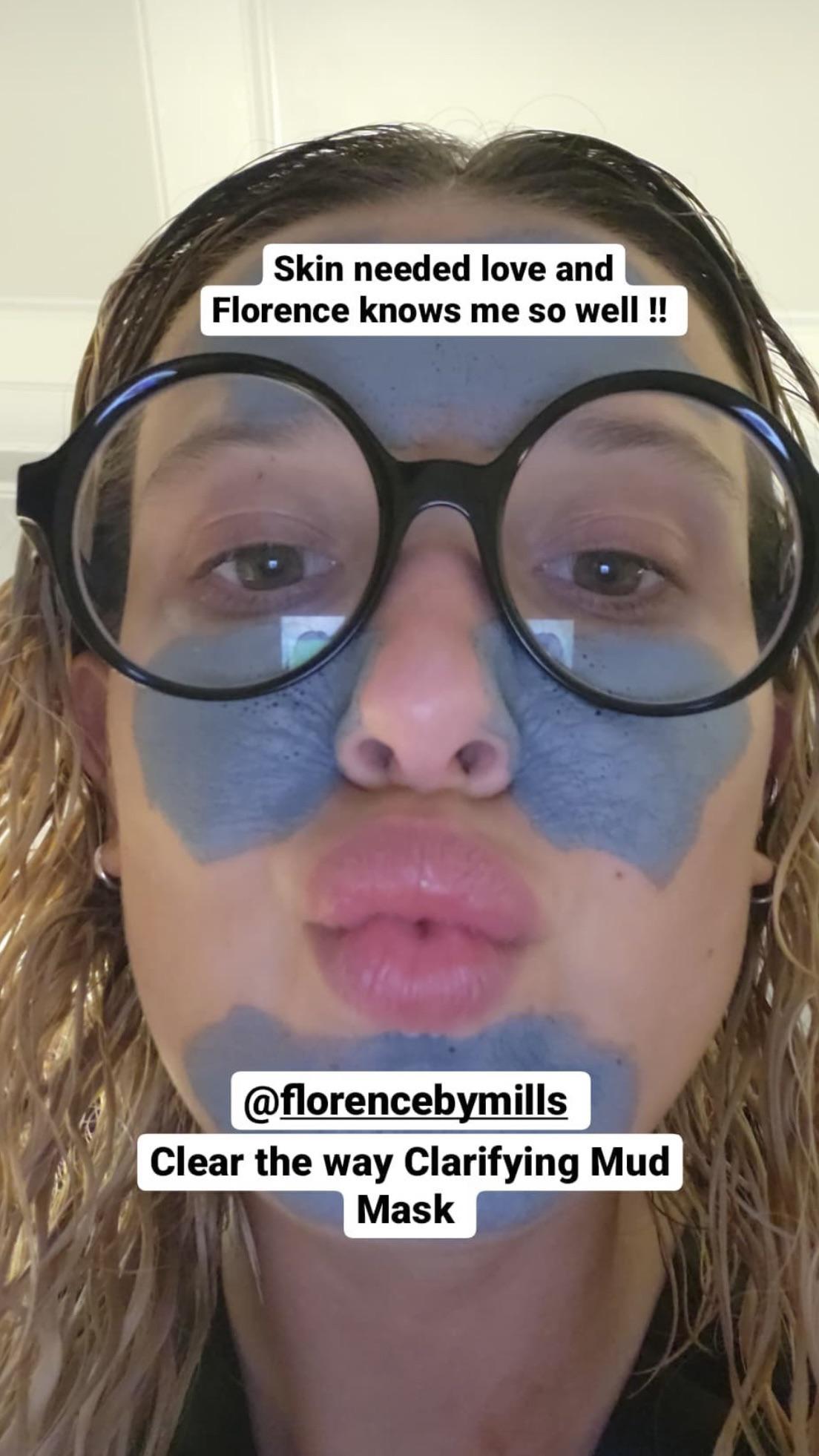 Dem lips | Scrolller