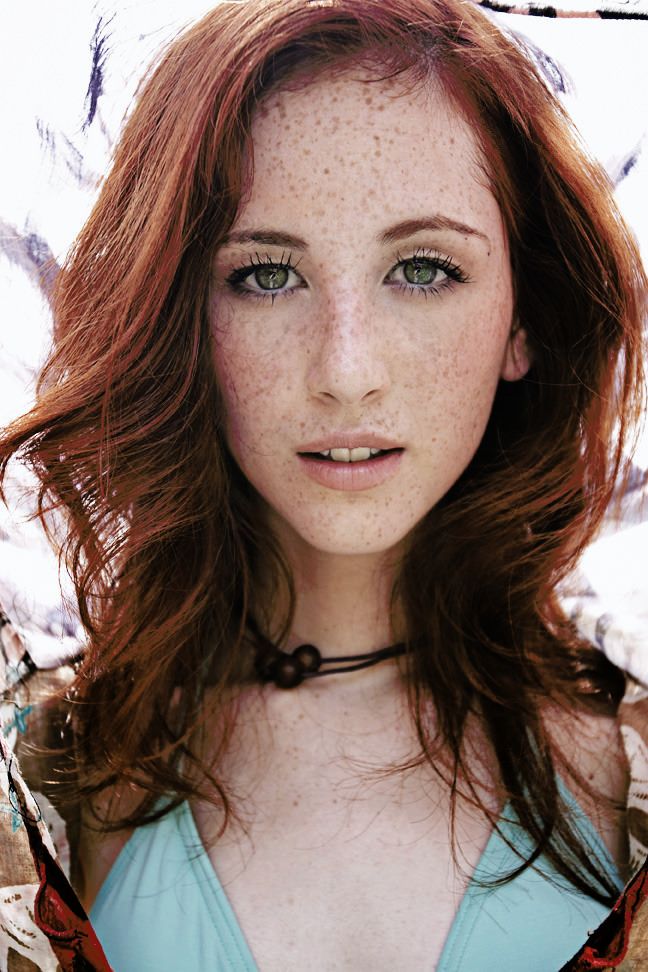 Freckle overload | Scrolller