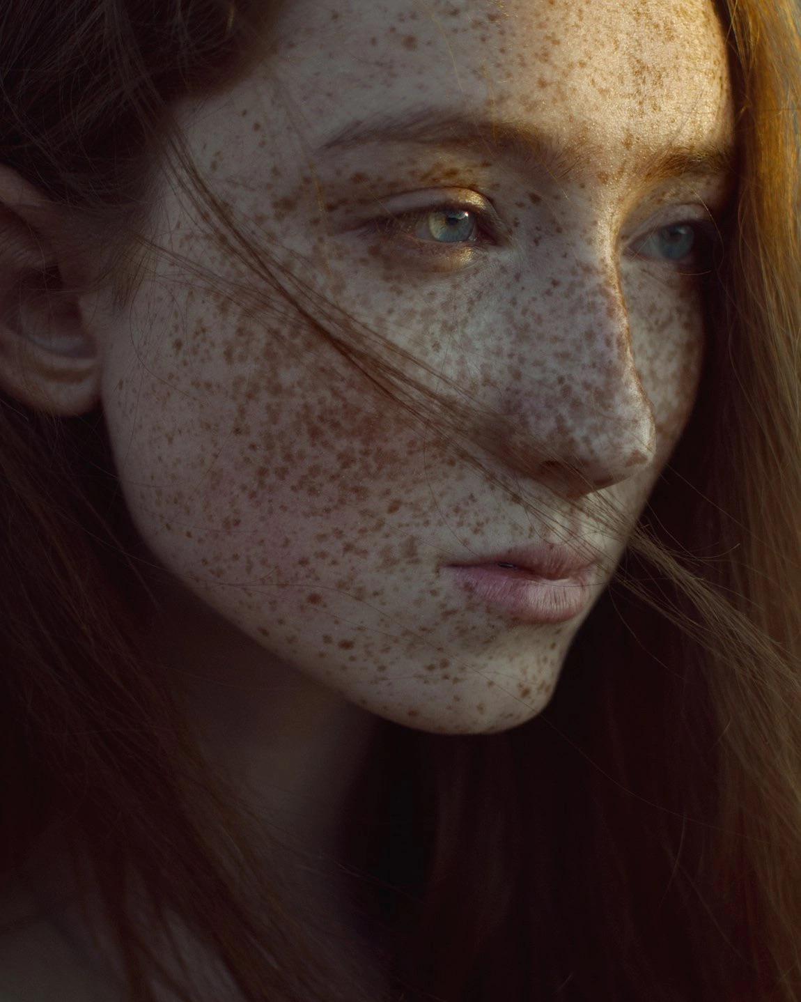 Freckles | Scrolller