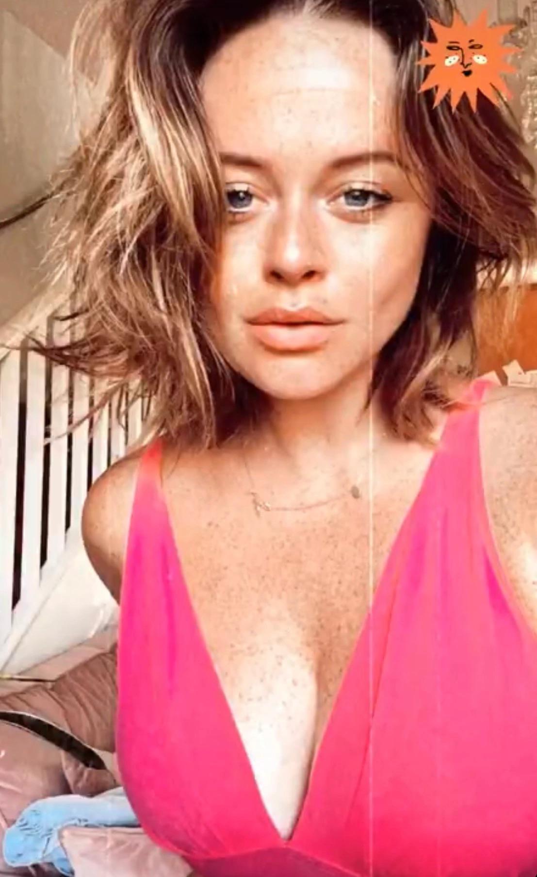 Freckles | Scrolller