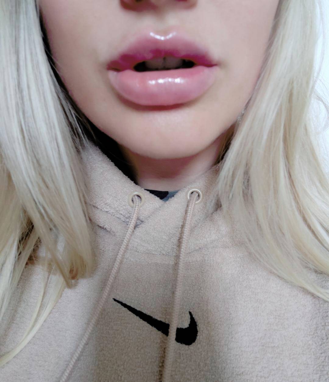 Fresh off the needle. Juicy lips💋 | Scrolller