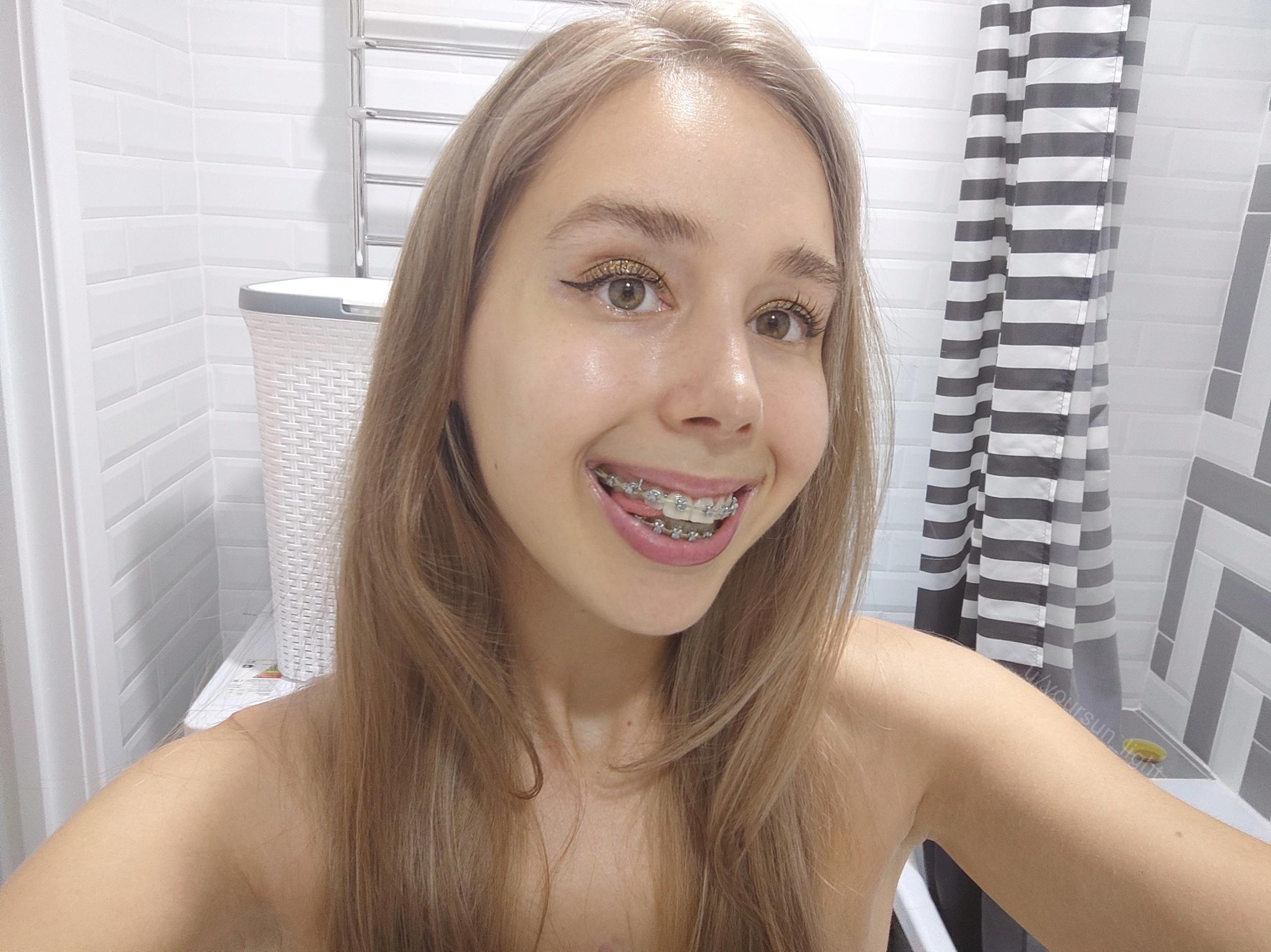 How many daddies wanna cum on my braces? I'm legal, don't worry 😋 | Scrolller