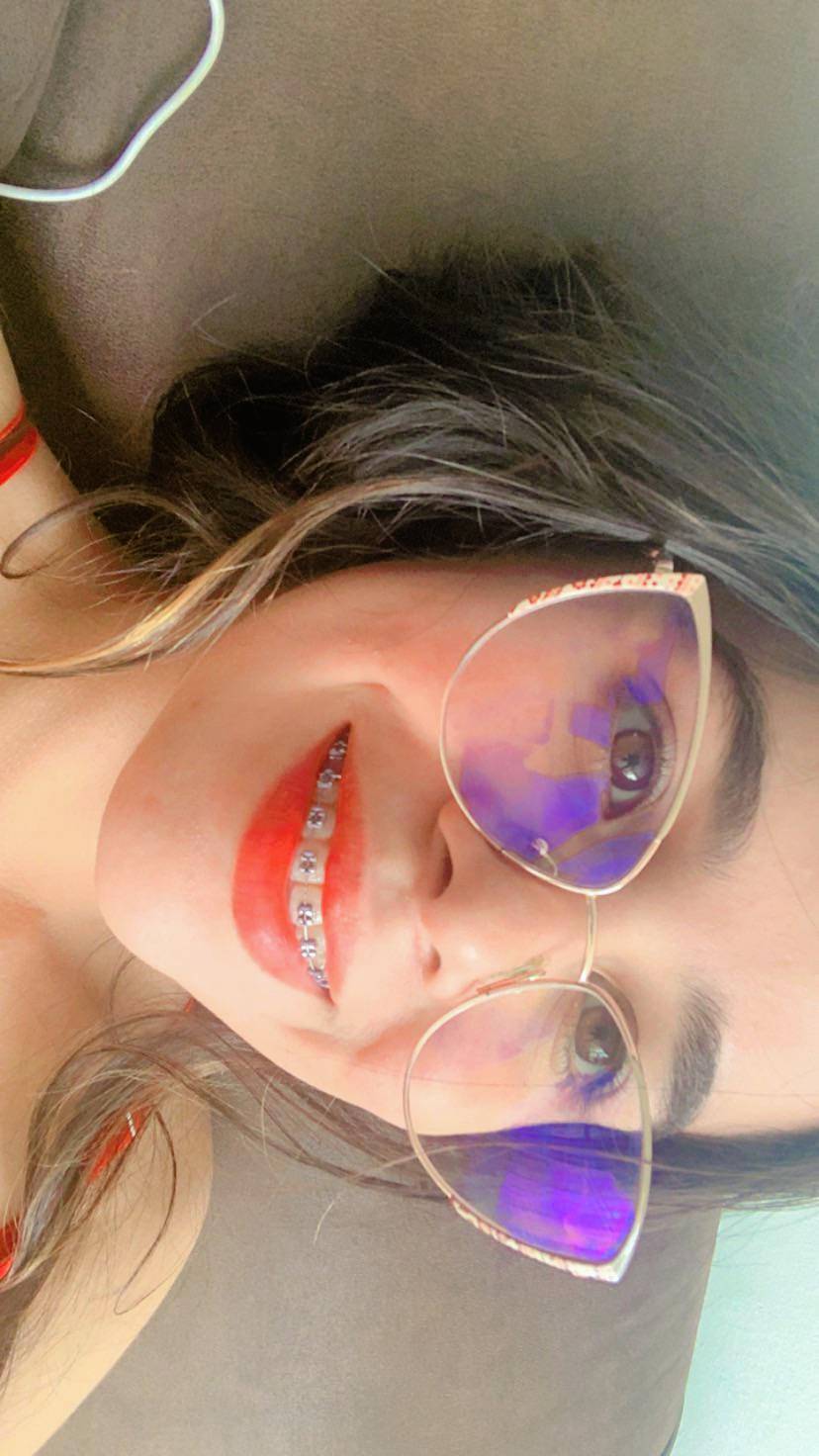 I Hope You Like My Braces… Do You Want To Play With Me😏🔥 Scrolller