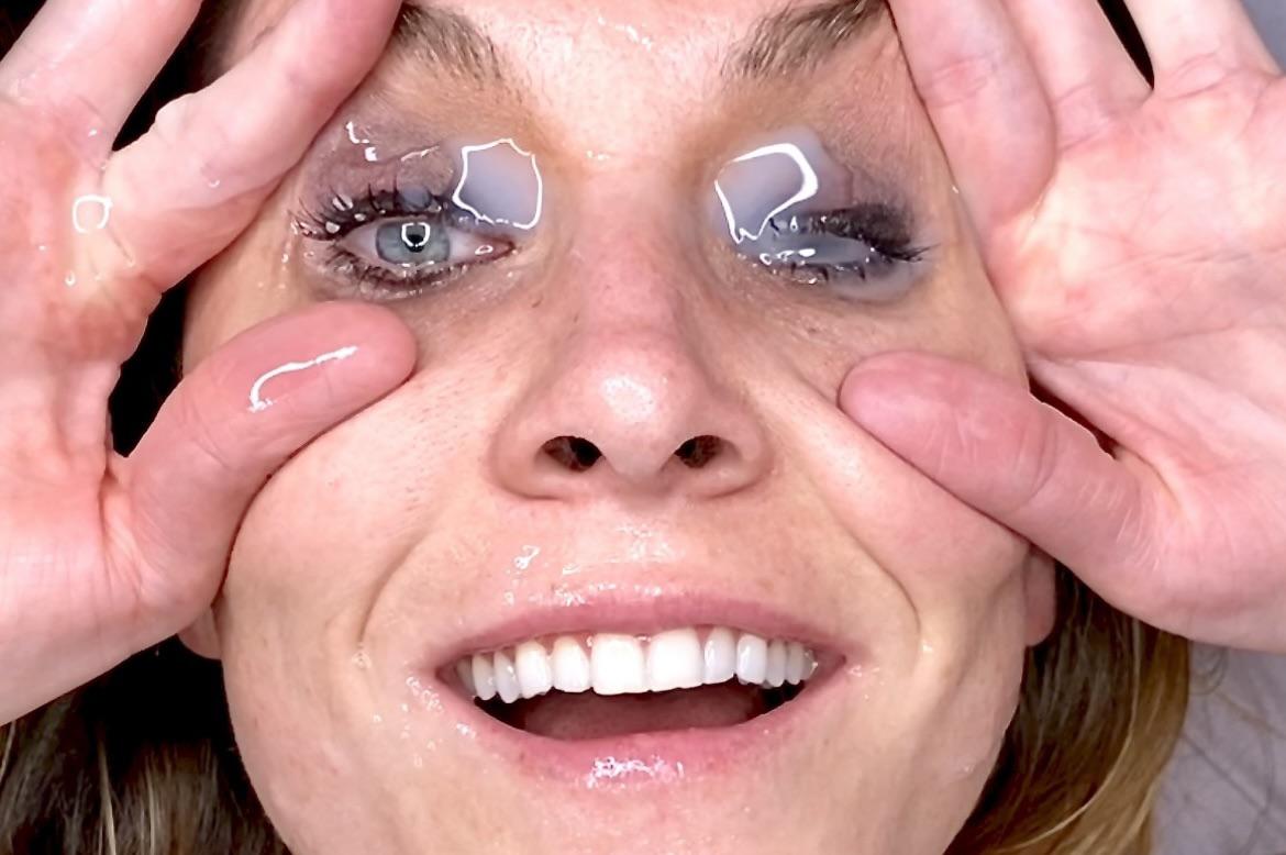 I just wish my right eye was filled too! | Scrolller