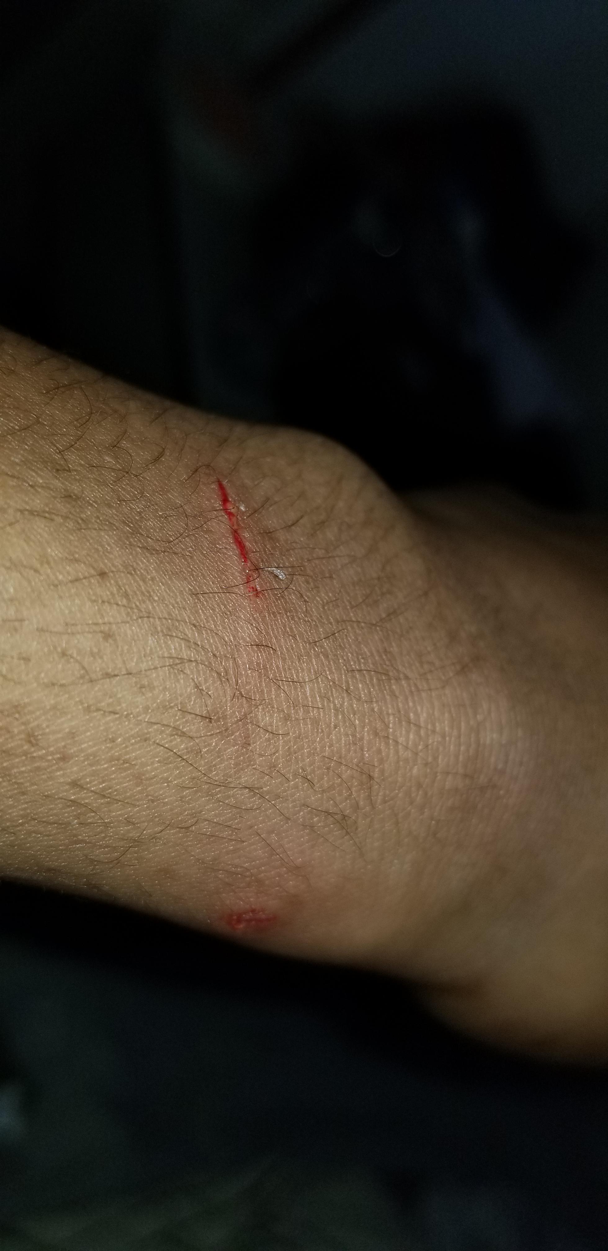 Boy Cut Hand With Blade