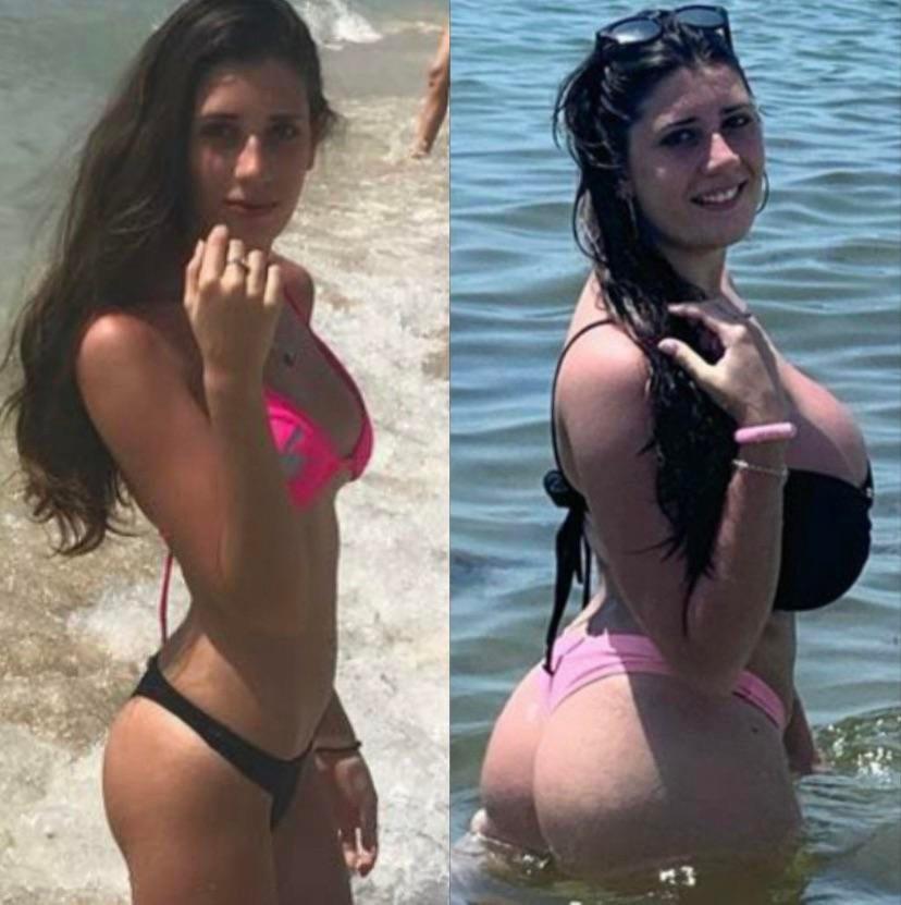 Macromastia | Scrolller