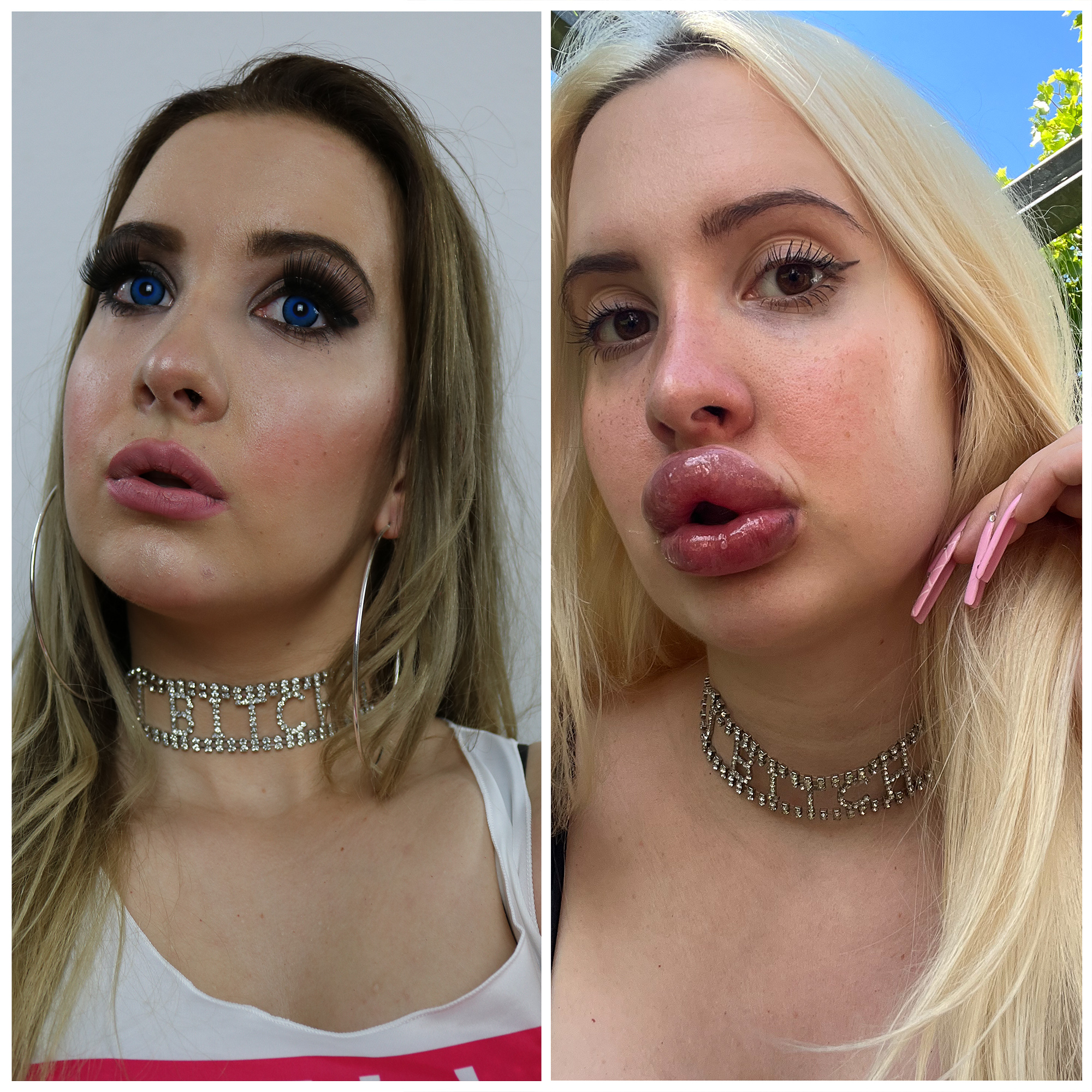My 2018 vs 2022 bimbofication | Scrolller