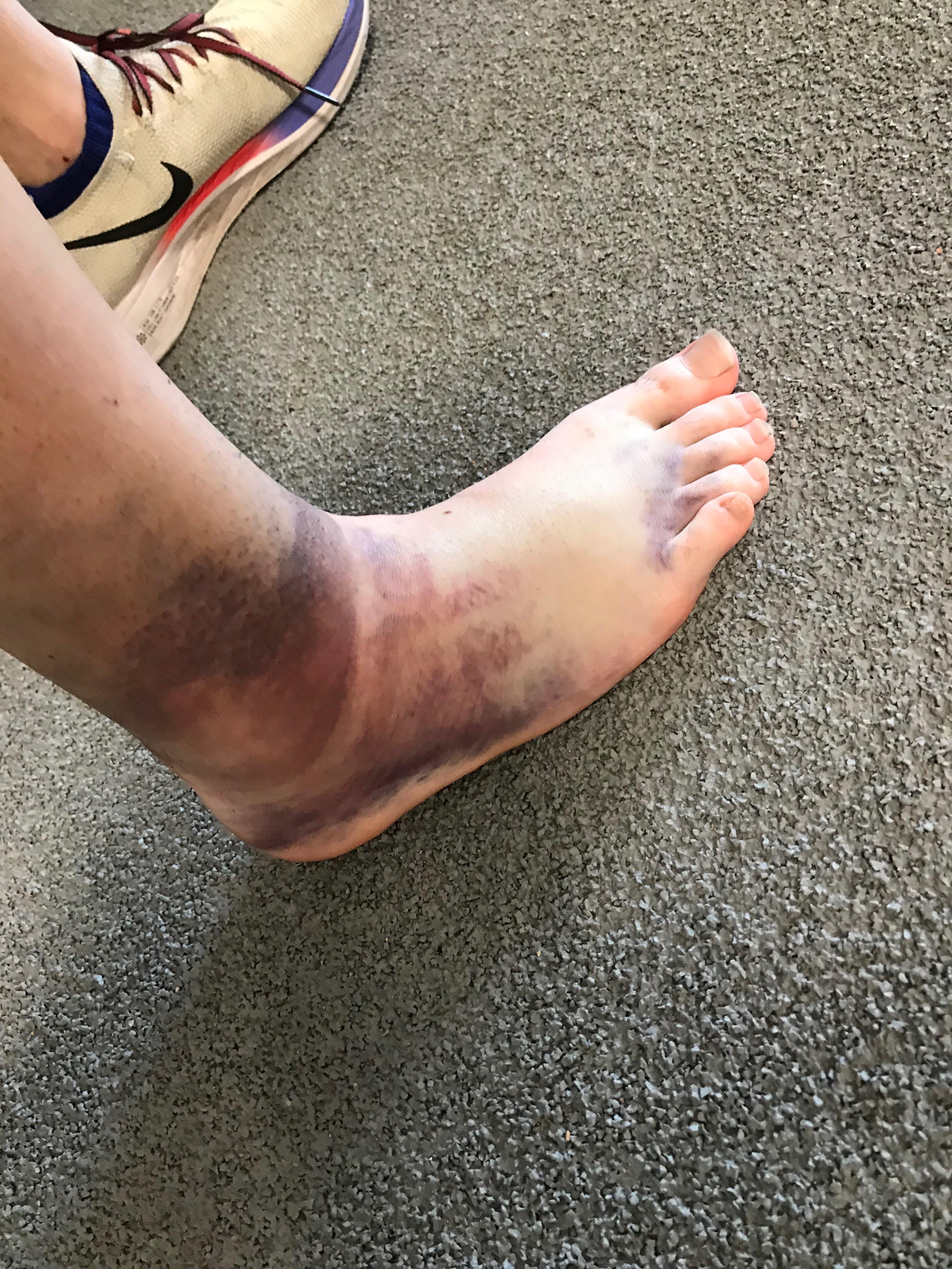 PSA from a friend, ”never let go of the pole.” | Scrolller