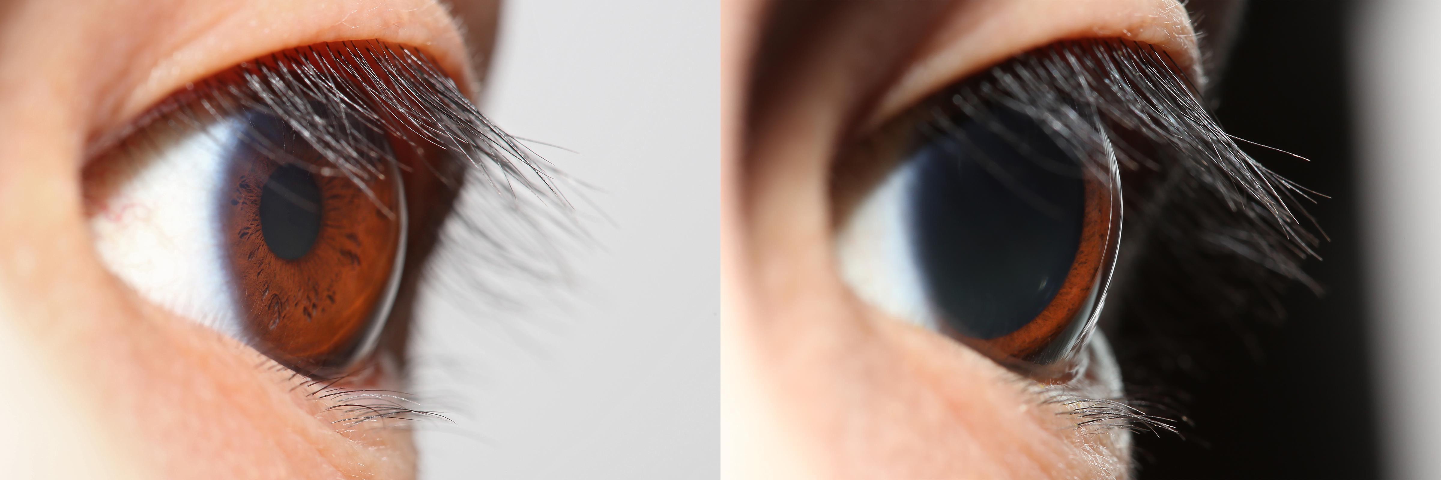 Pupil constriction and dilation showing size range | Scrolller