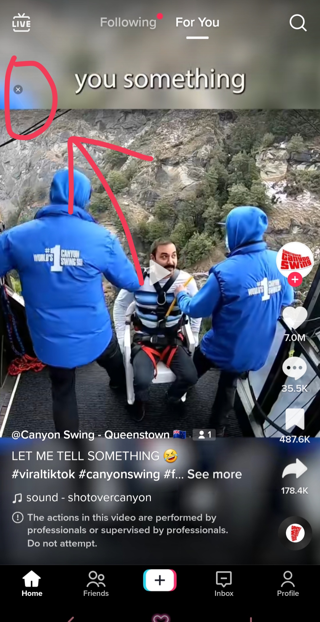 Random X top left corner of my screen? | Scrolller