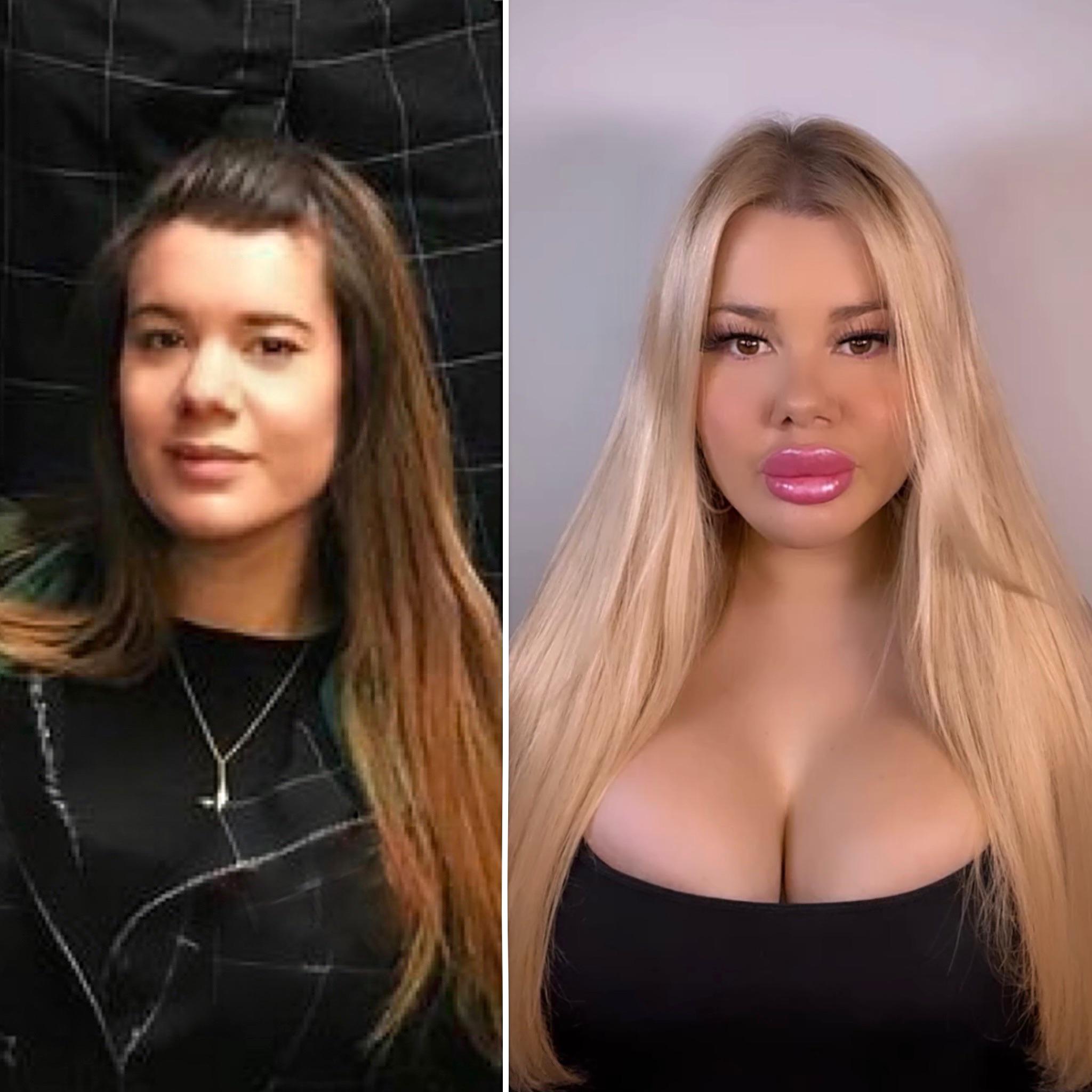 The plastic is taking over 😍 | Scrolller