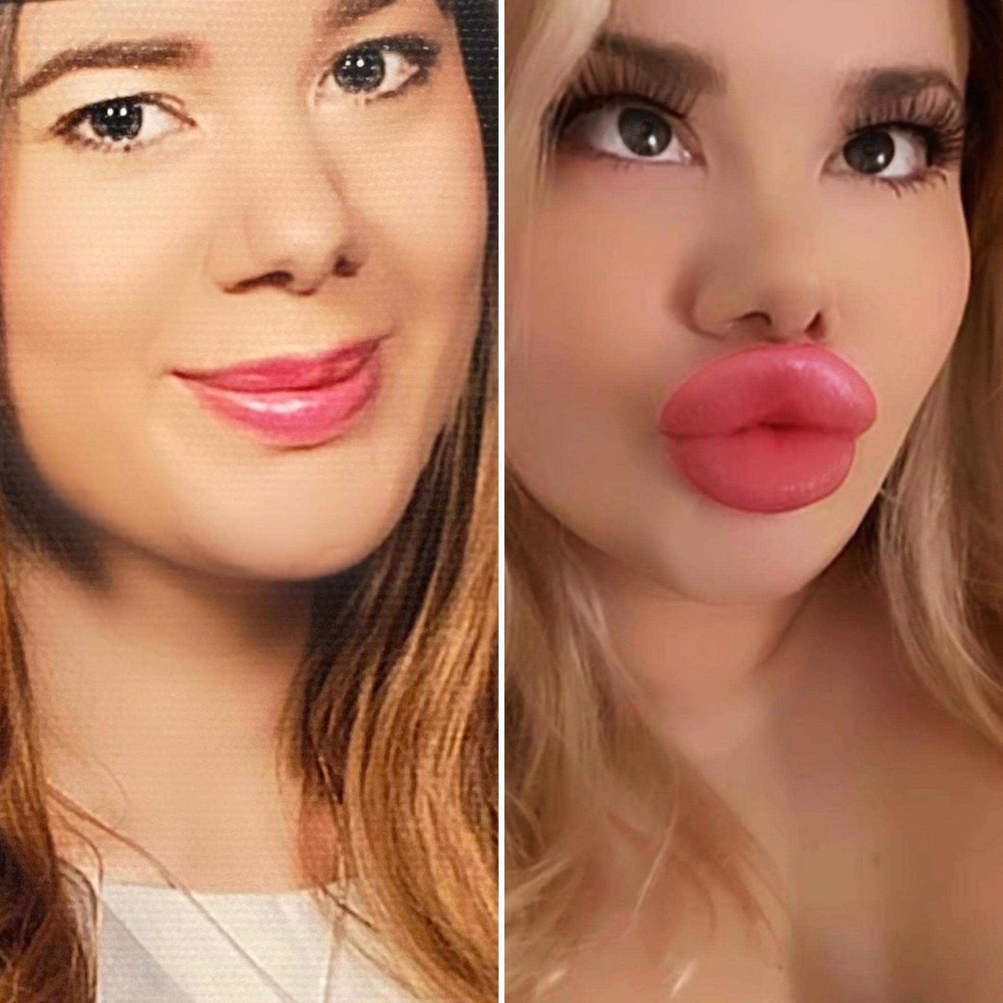 Then and now | Scrolller