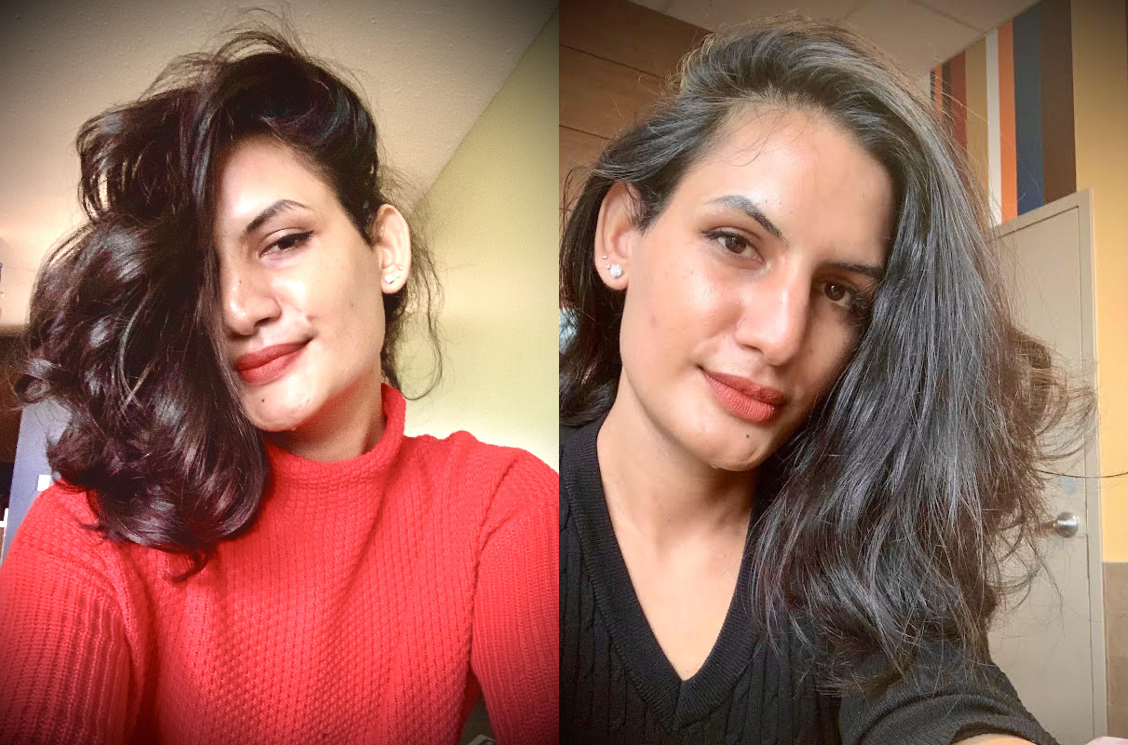 Three months on hrt. How am I doing so far? | Scrolller