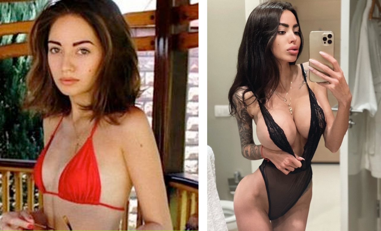 Transformation: 5 year | Scrolller