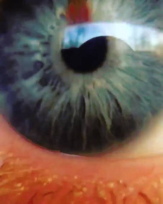 When you move your eye, the fluid inside doesn't move instantly. This ...