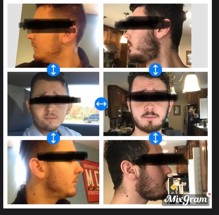 1 year progress, consistency is key! | Scrolller