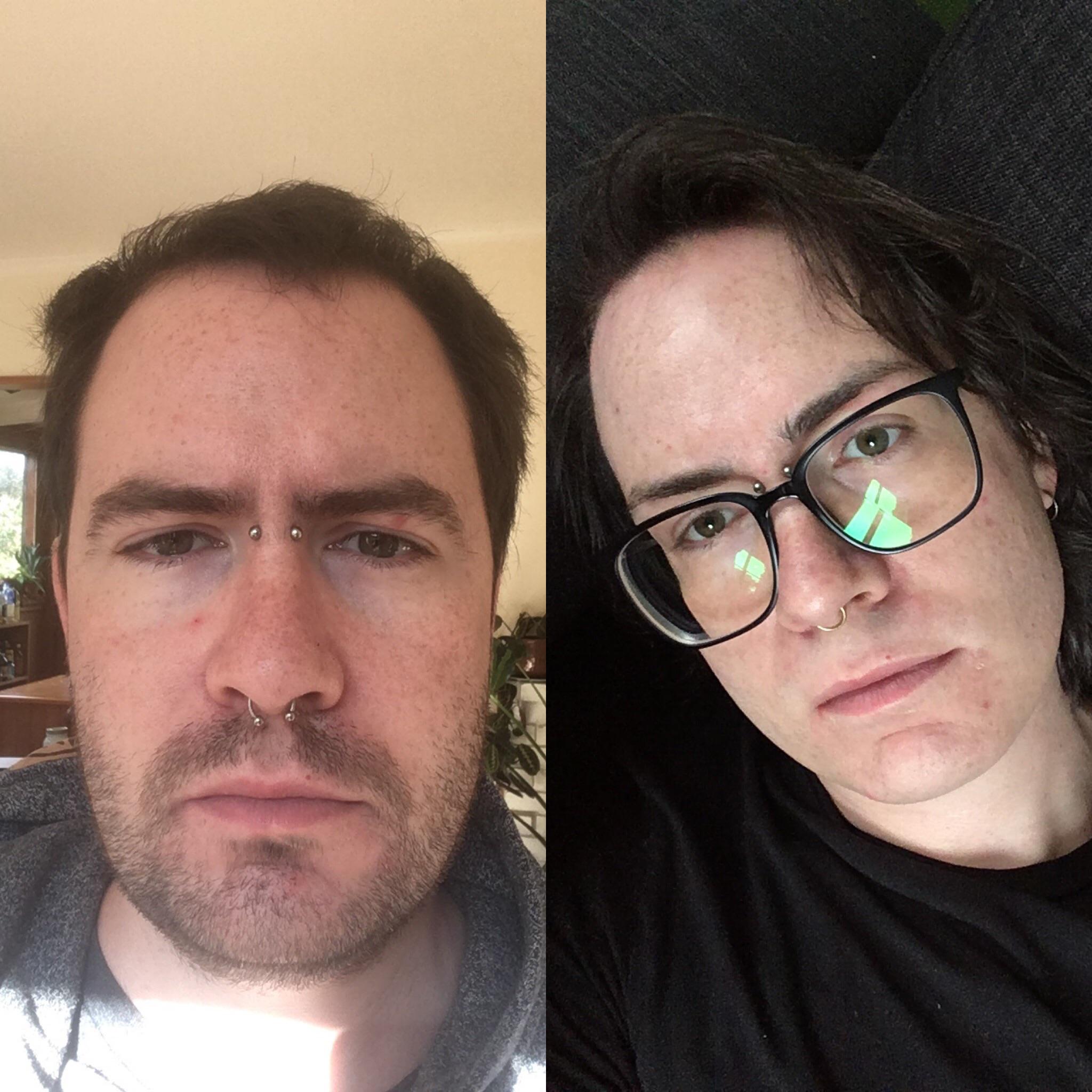 13 months on estradiol, finally feel like I’m getting somewhere ☺️ | Scrolller