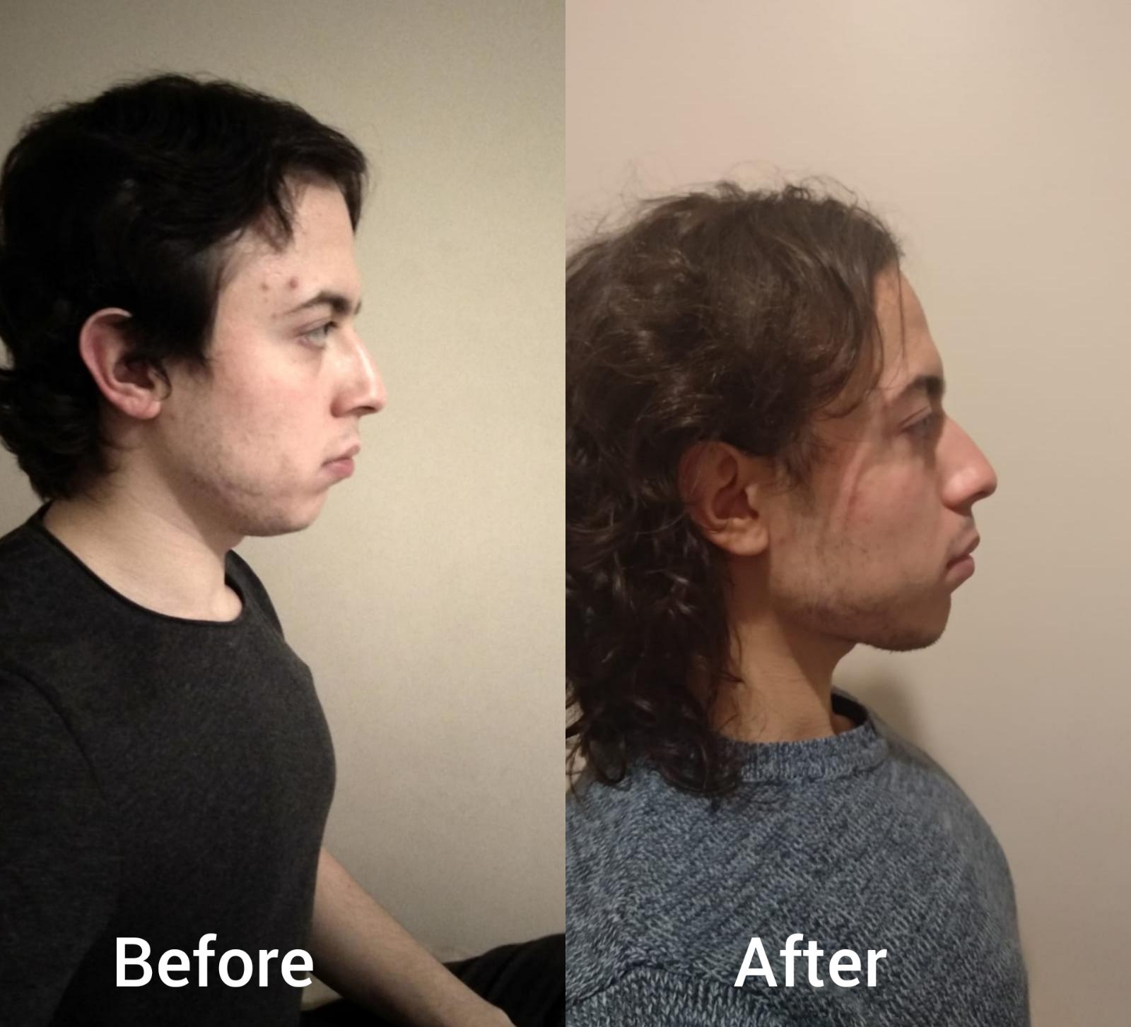 15 Months Of Mewing And Chewing Falim Gum Scrolller