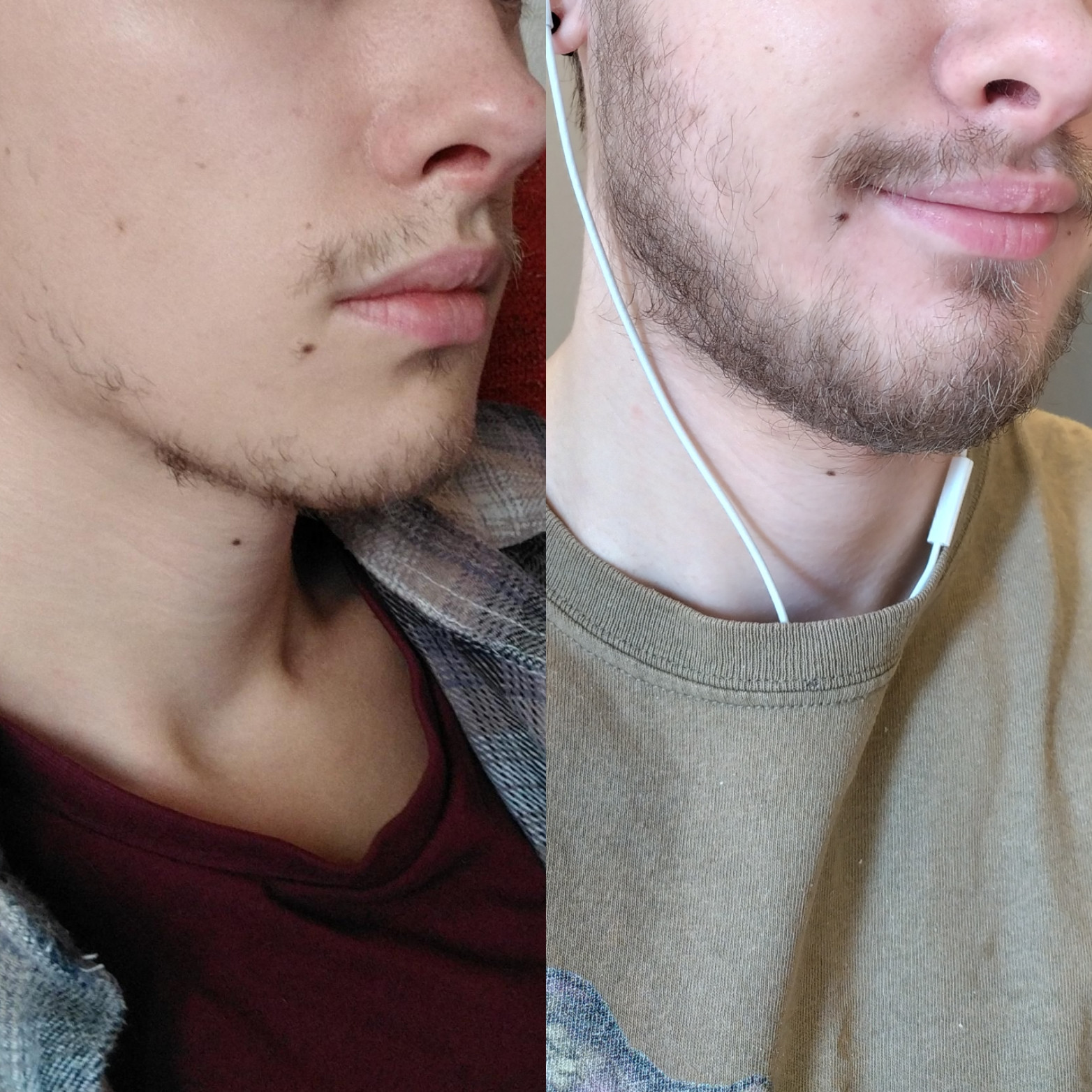 1st day Vs 9 months | Scrolller