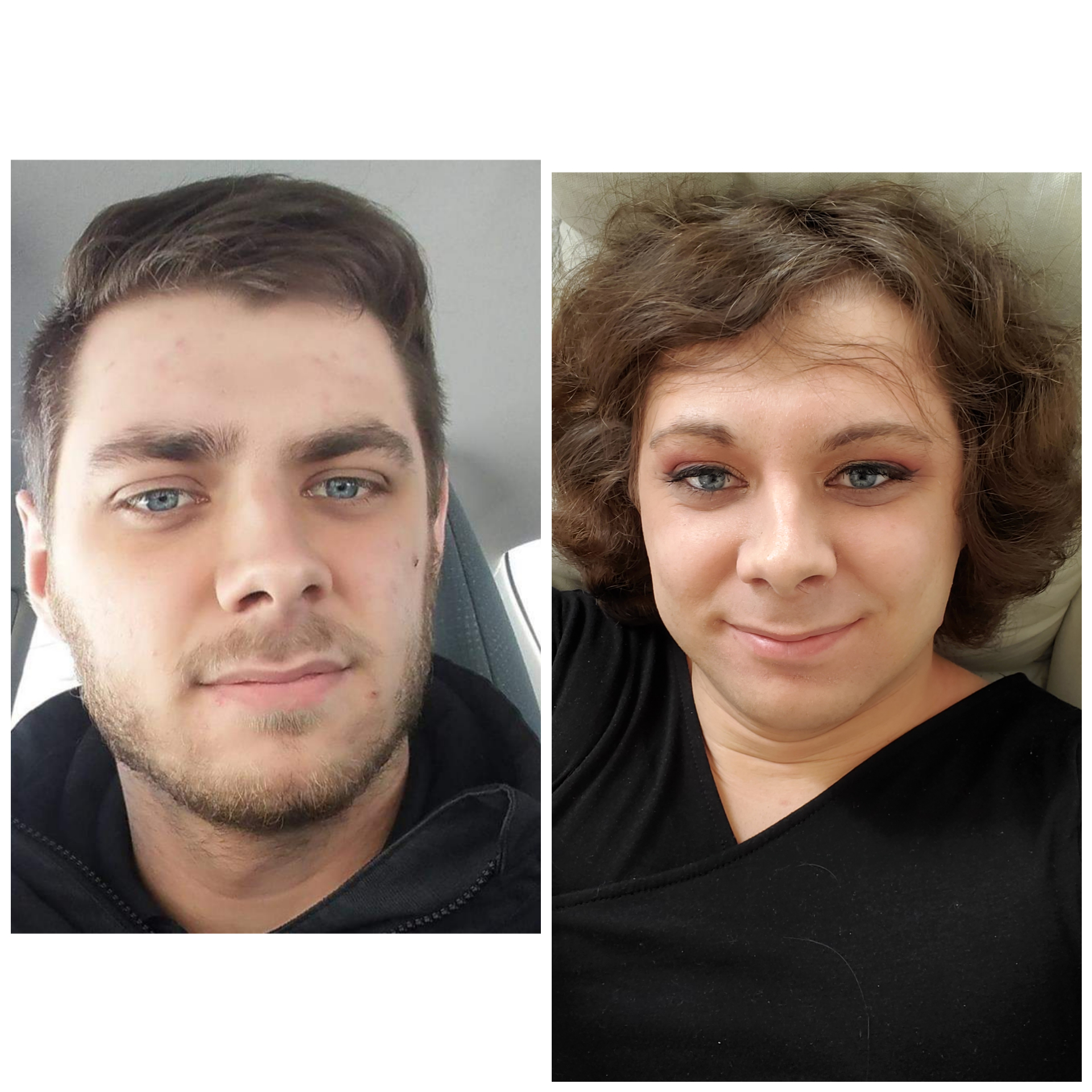 -1year HRT and 1 month HRT! | Scrolller