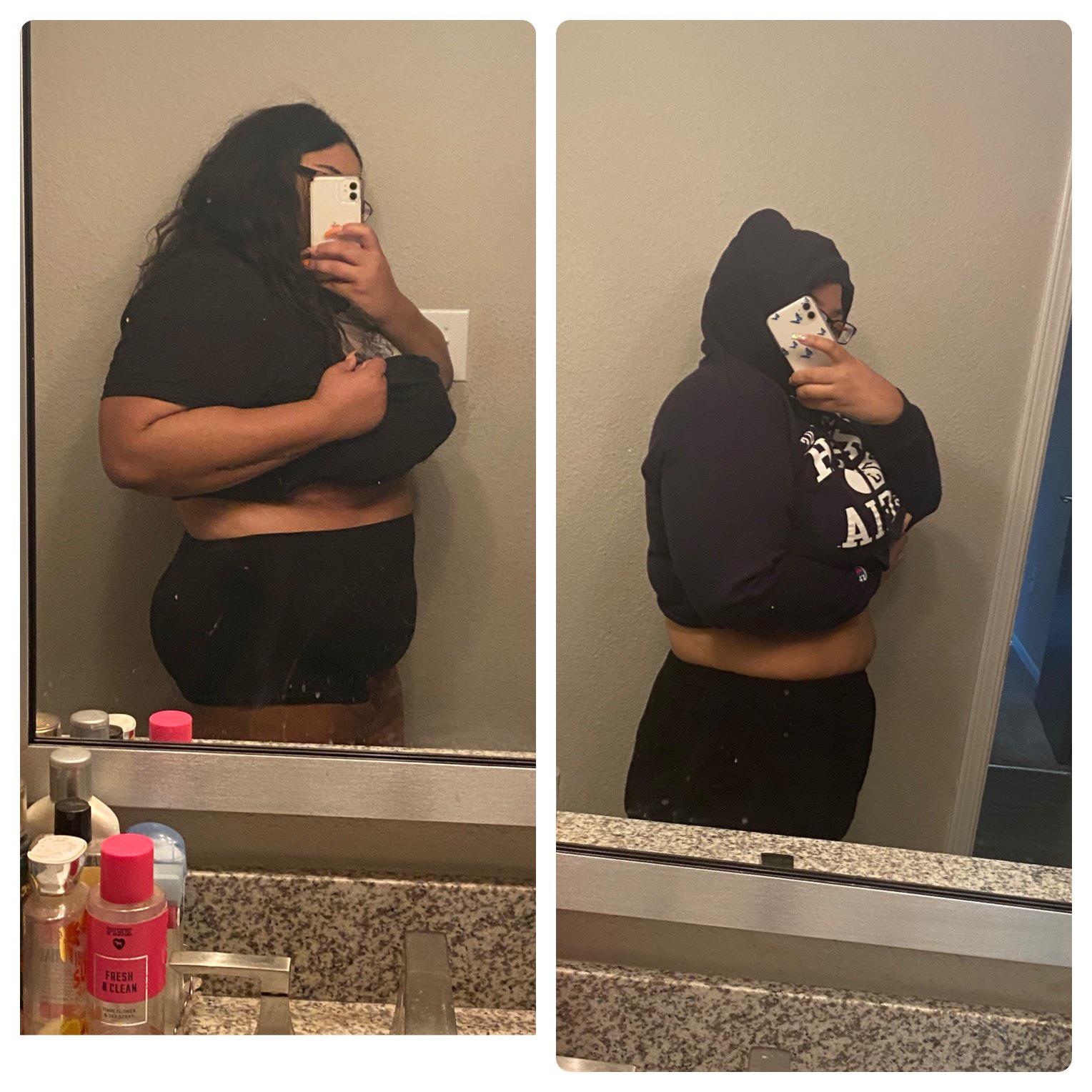 2.5 months Post-op | Scrolller