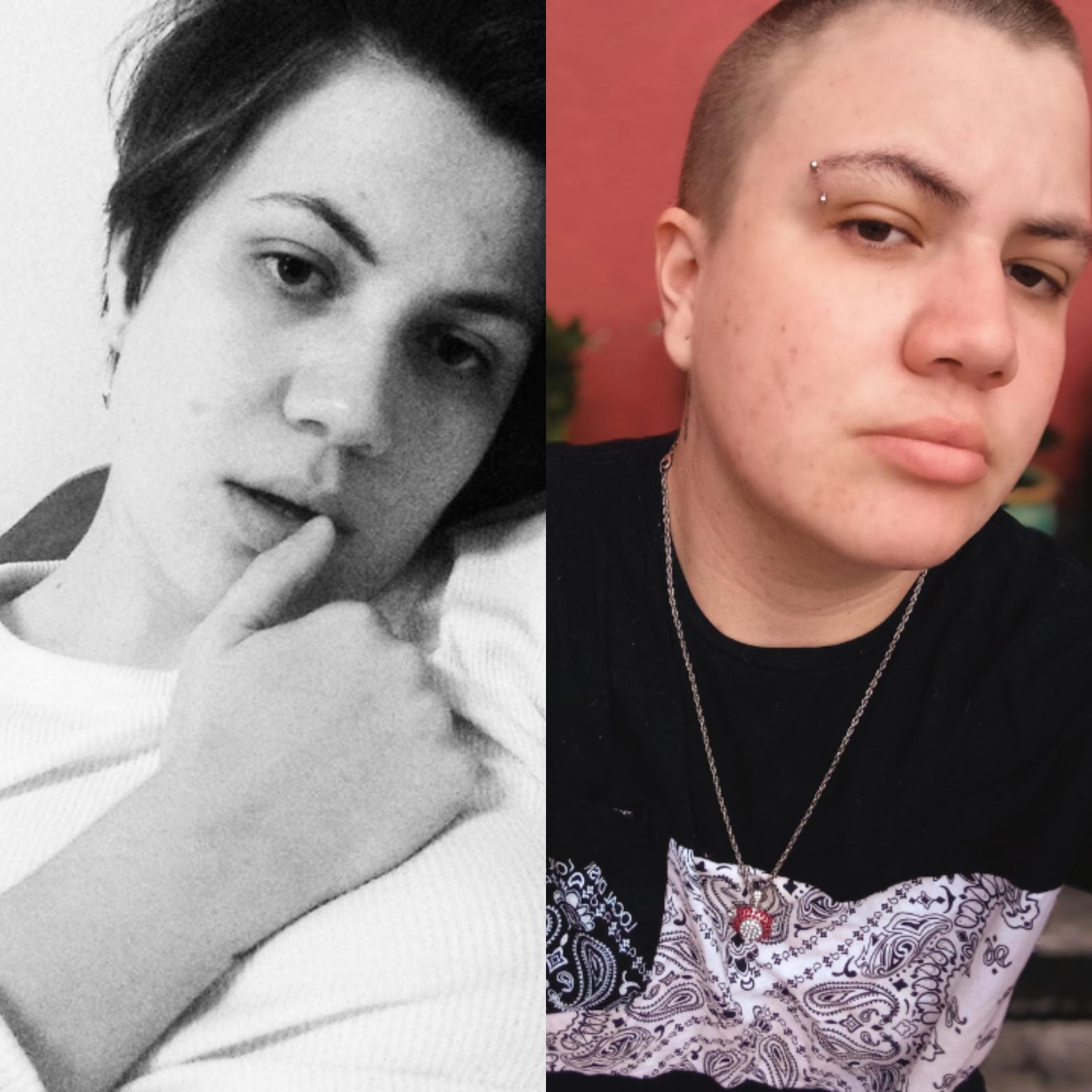2017 (pre-T) / 2021 (2 months on T). Any changes? | Scrolller