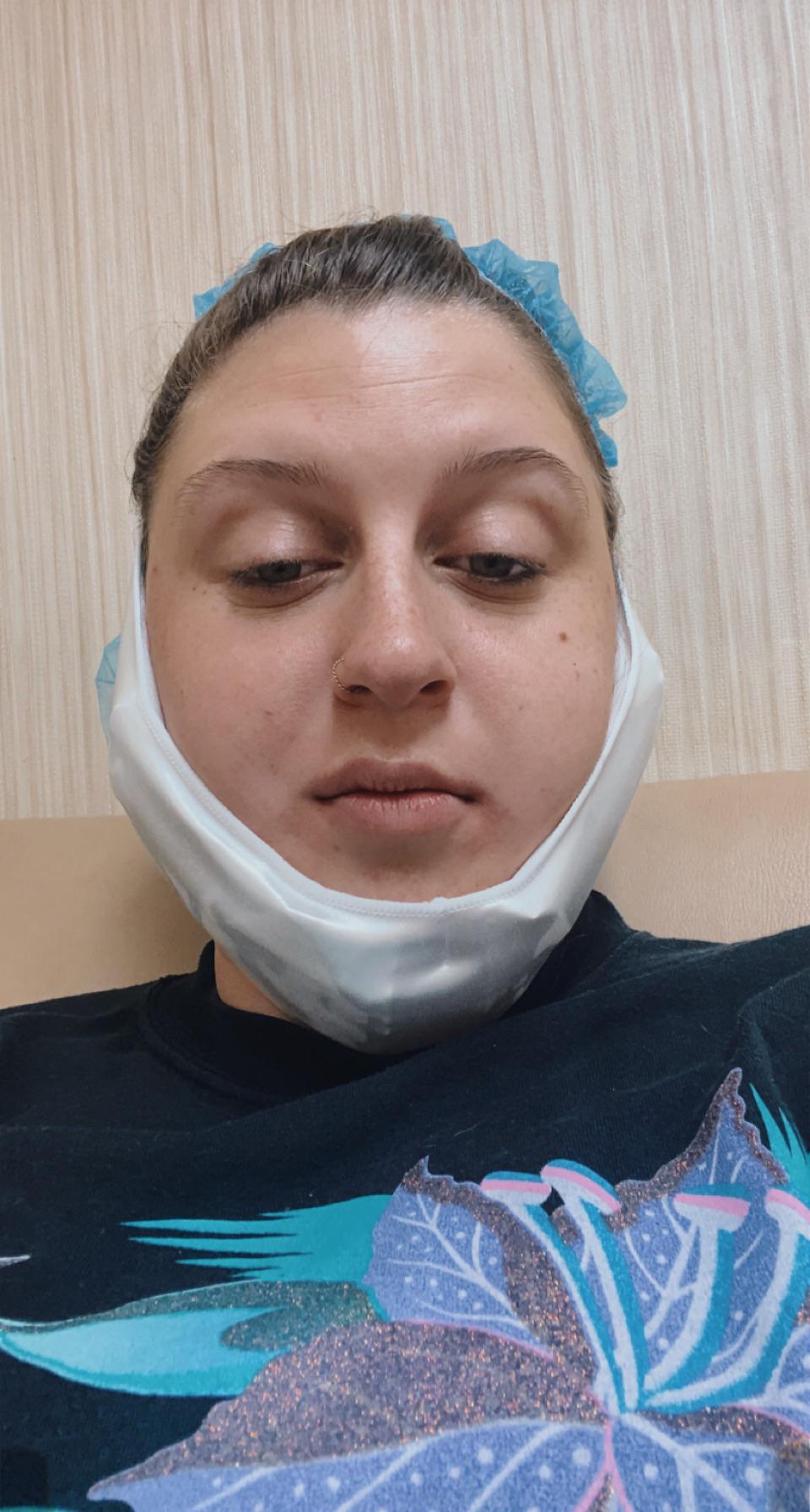 Surgery went well 🦷 | Scrolller