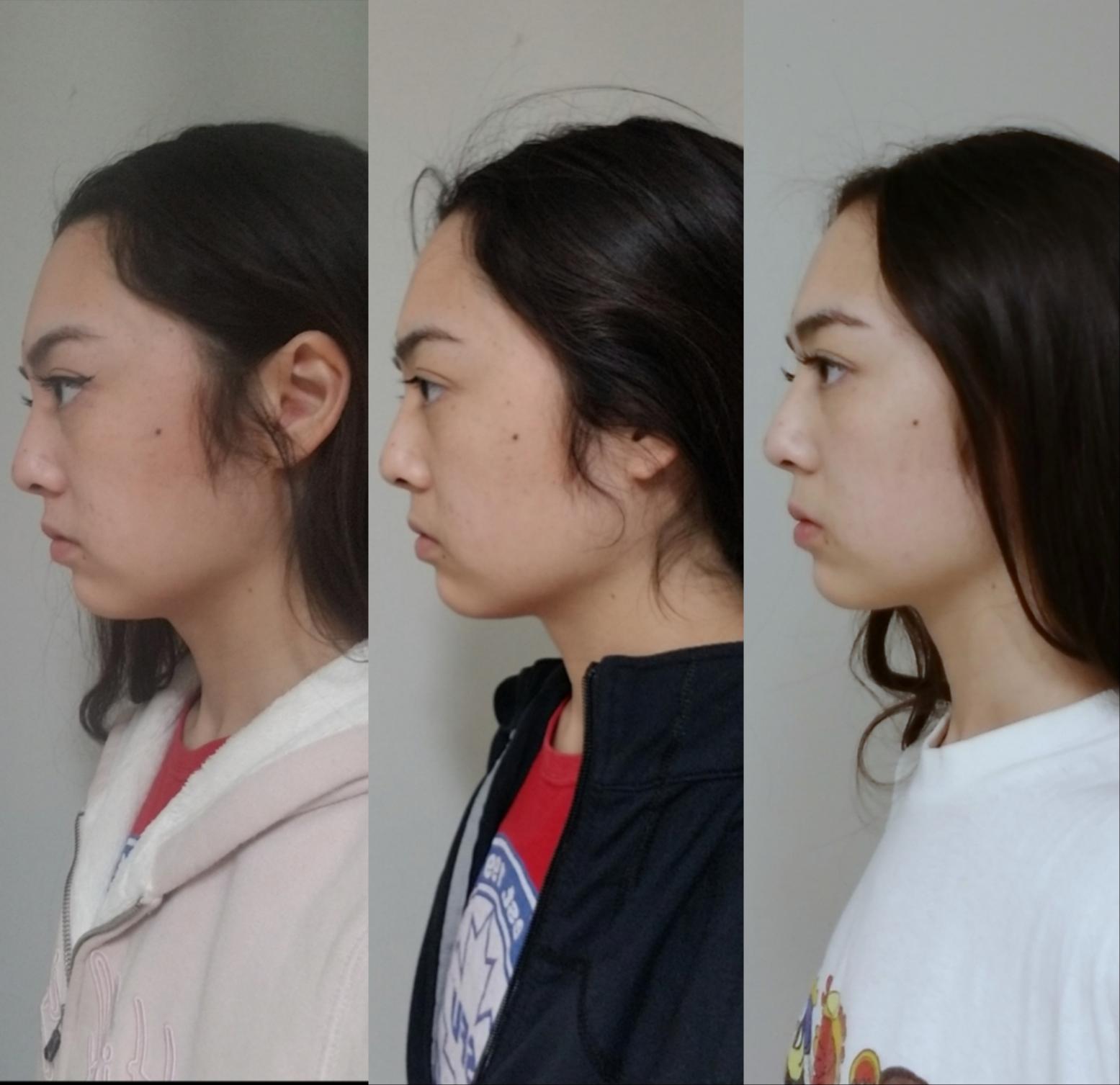 3 month mewing update! Gained roughly 5lbs this month | Scrolller