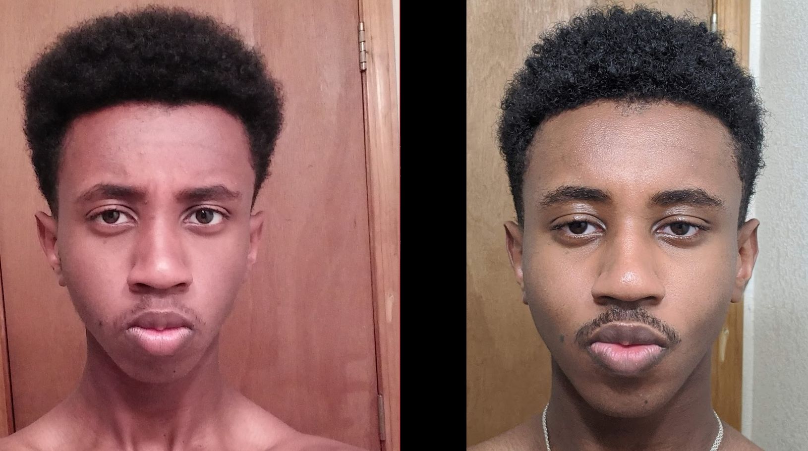 3-year mewing results (left 16 right 19) | Scrolller