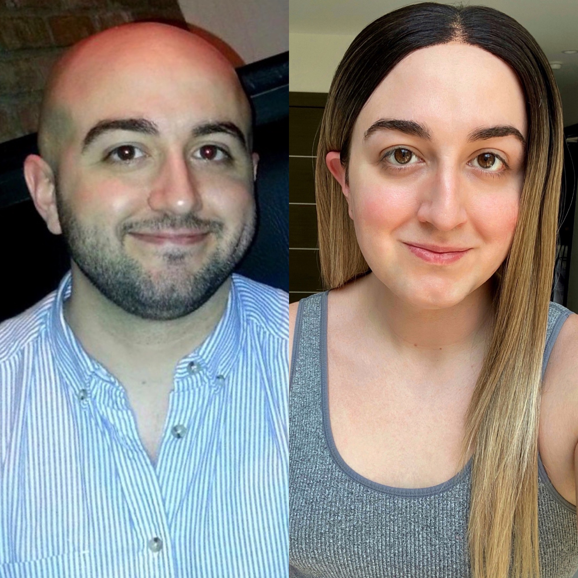 3 years apart (2+ years on GAHT) | Scrolller